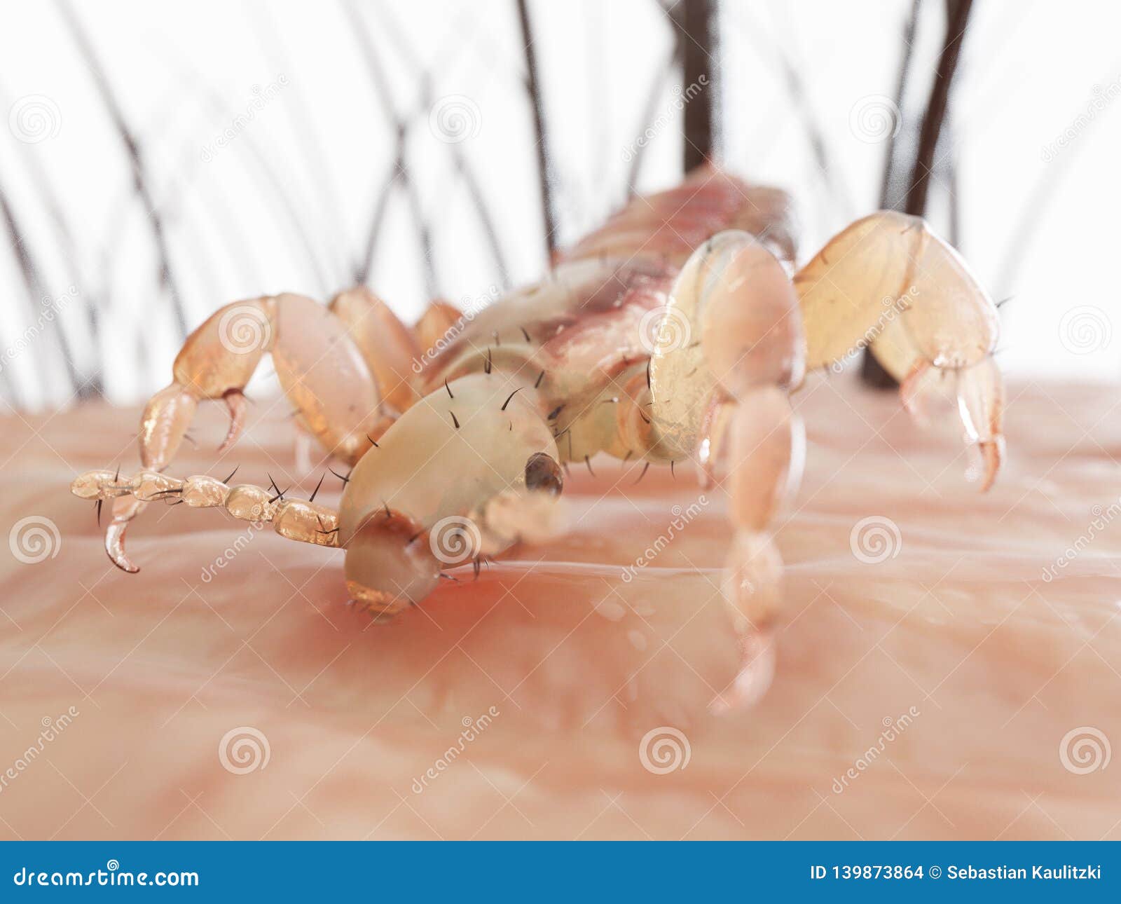 A head louse stock illustration. Illustration of microscopy - 139873864