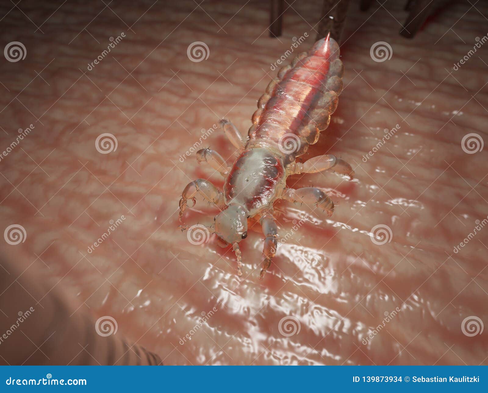A head louse stock illustration. Illustration of creepy - 139873934