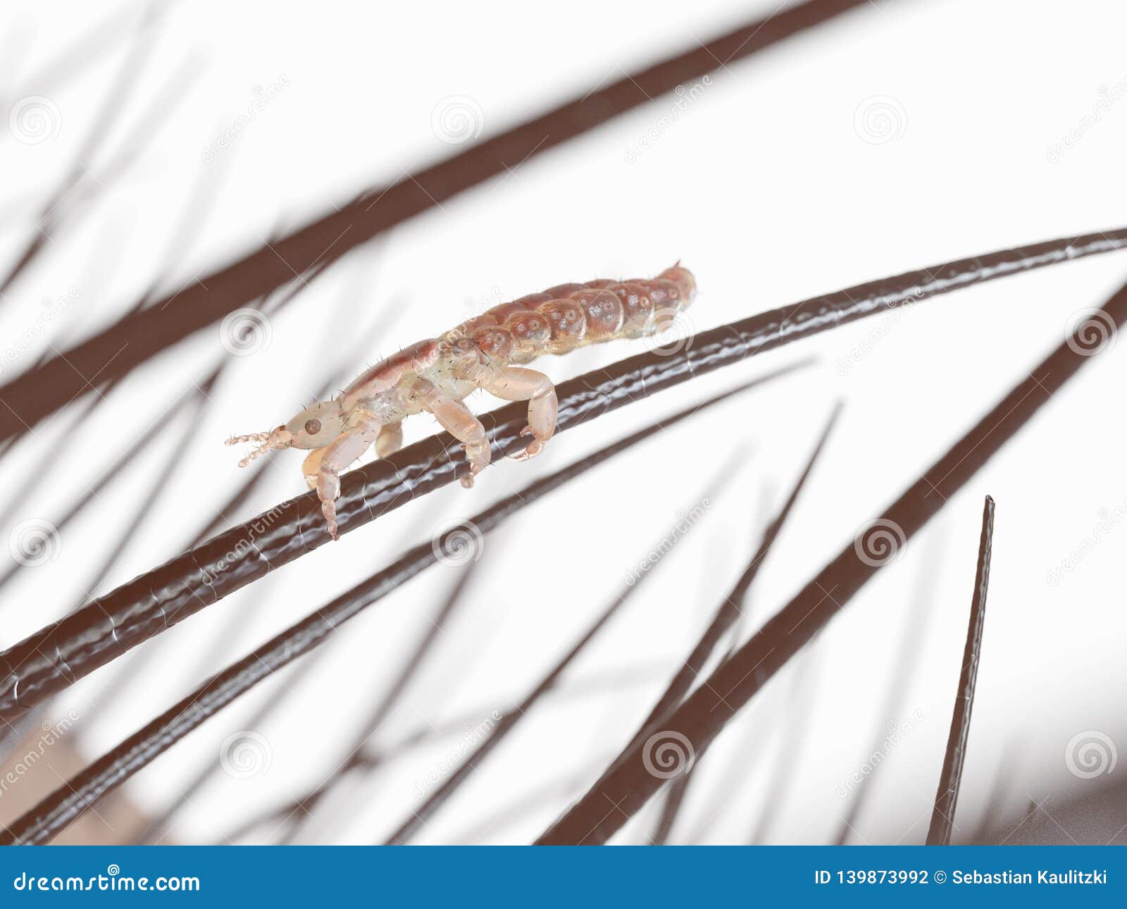 A head louse stock illustration. Illustration of macro - 139873992
