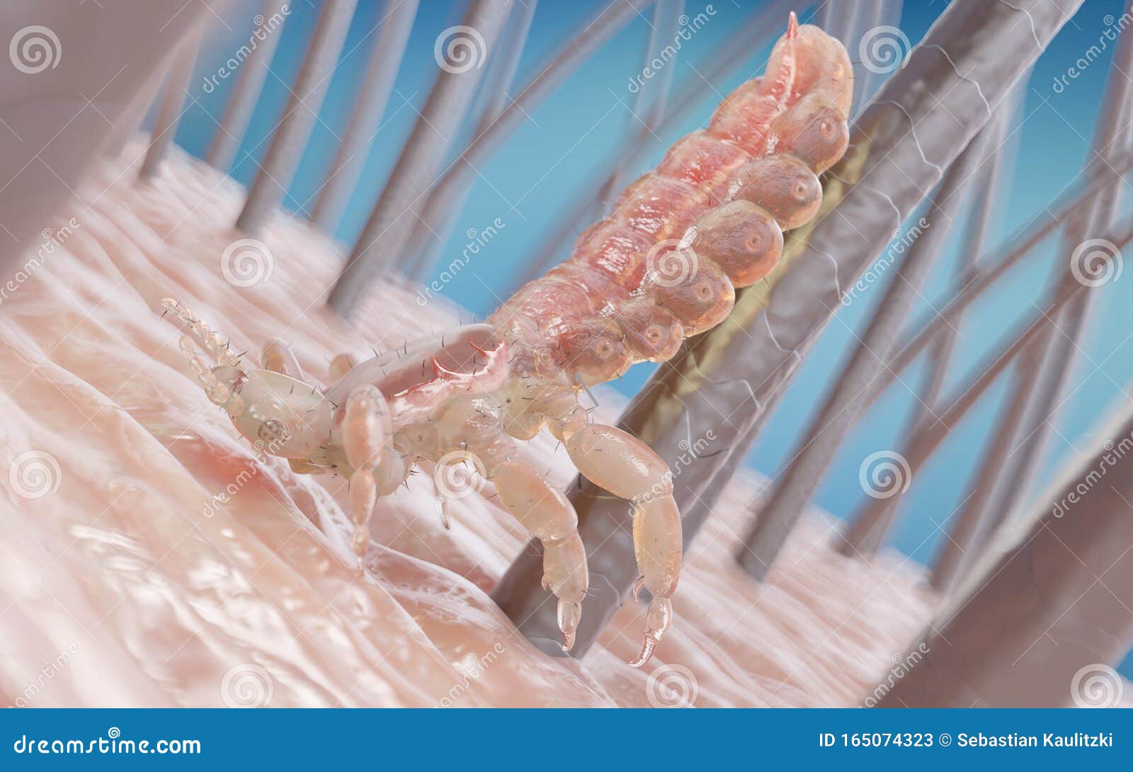 A head louse stock illustration. Illustration of contagious - 165074323