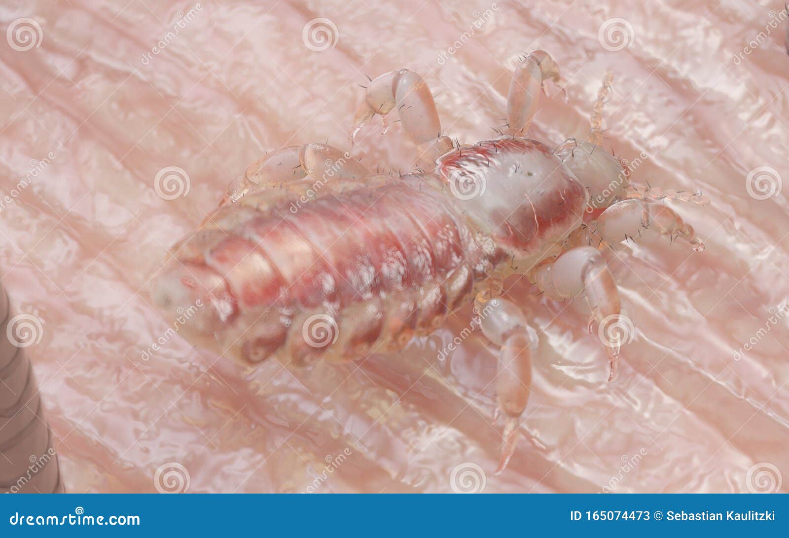 A head louse stock illustration. Illustration of head - 165074473