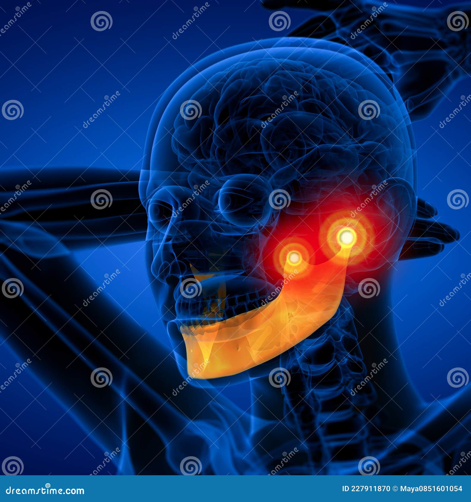 3d Rendered Illustration - Jaw Bone Stock Illustration - Illustration ...