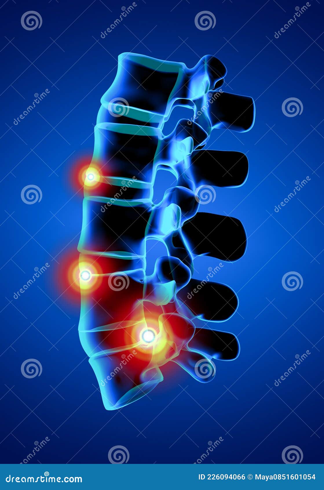 3D Rendering Illustration of Lumbar Stock Illustration - Illustration ...