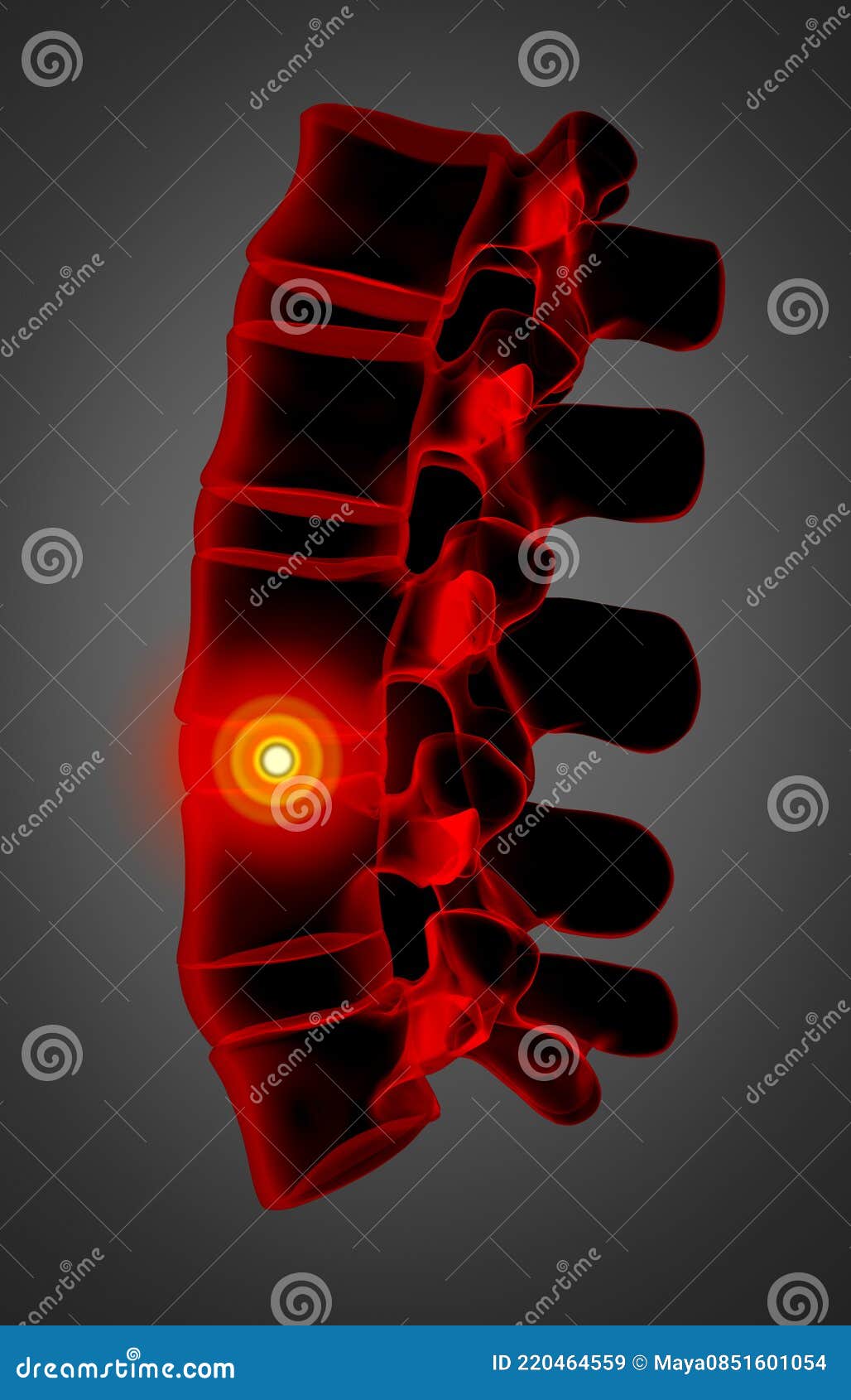 3D Rendering Illustration of Lumbar Stock Illustration - Illustration ...