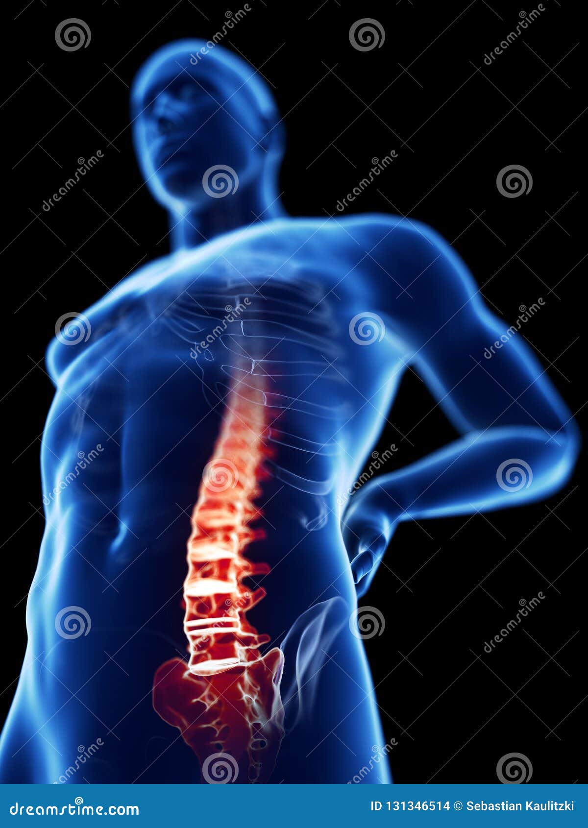 A man having backache stock illustration. Illustration of arthrosis ...
