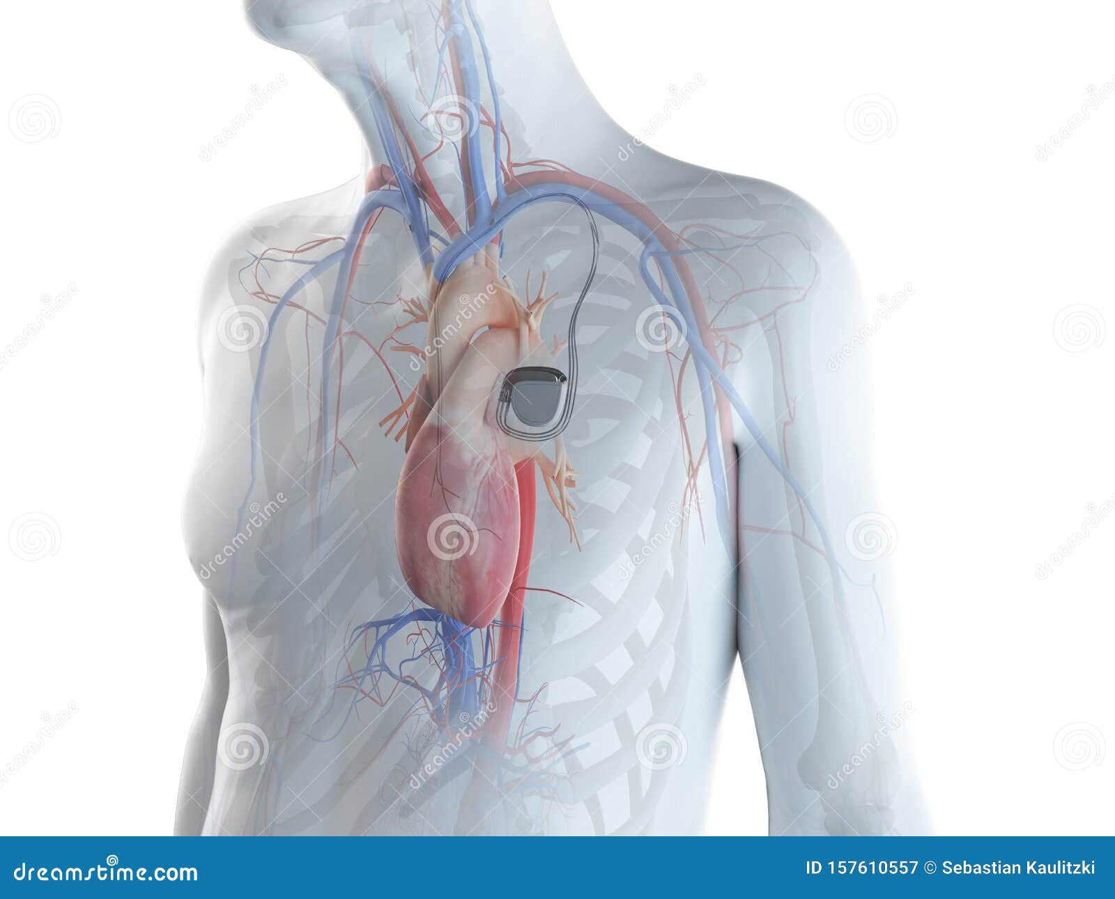 Pace Cartoons, Illustrations & Vector Stock Images - 8818 Pictures to ...