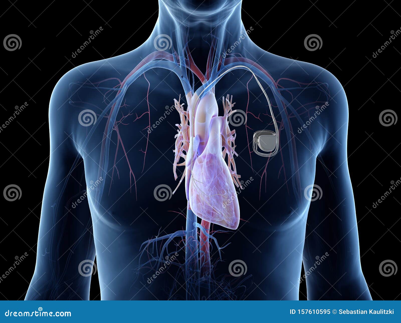 Pace Cartoons, Illustrations & Vector Stock Images - 8818 Pictures to ...