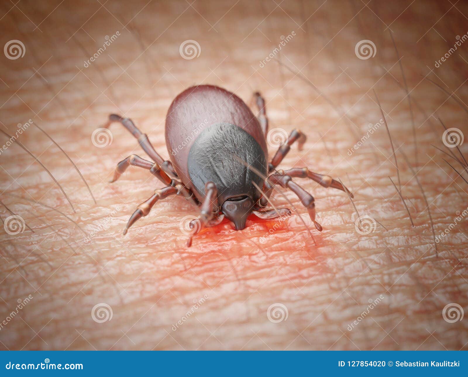 A tick stock illustration. Illustration of illness, macro - 127854020