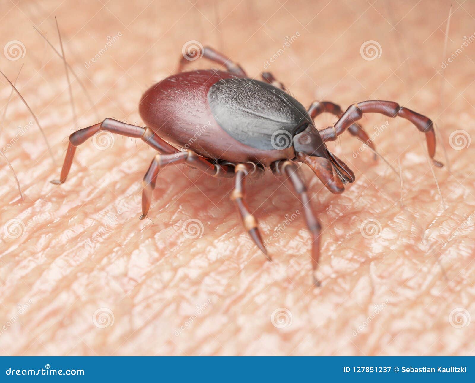 A tick stock illustration. Illustration of infection - 127851237