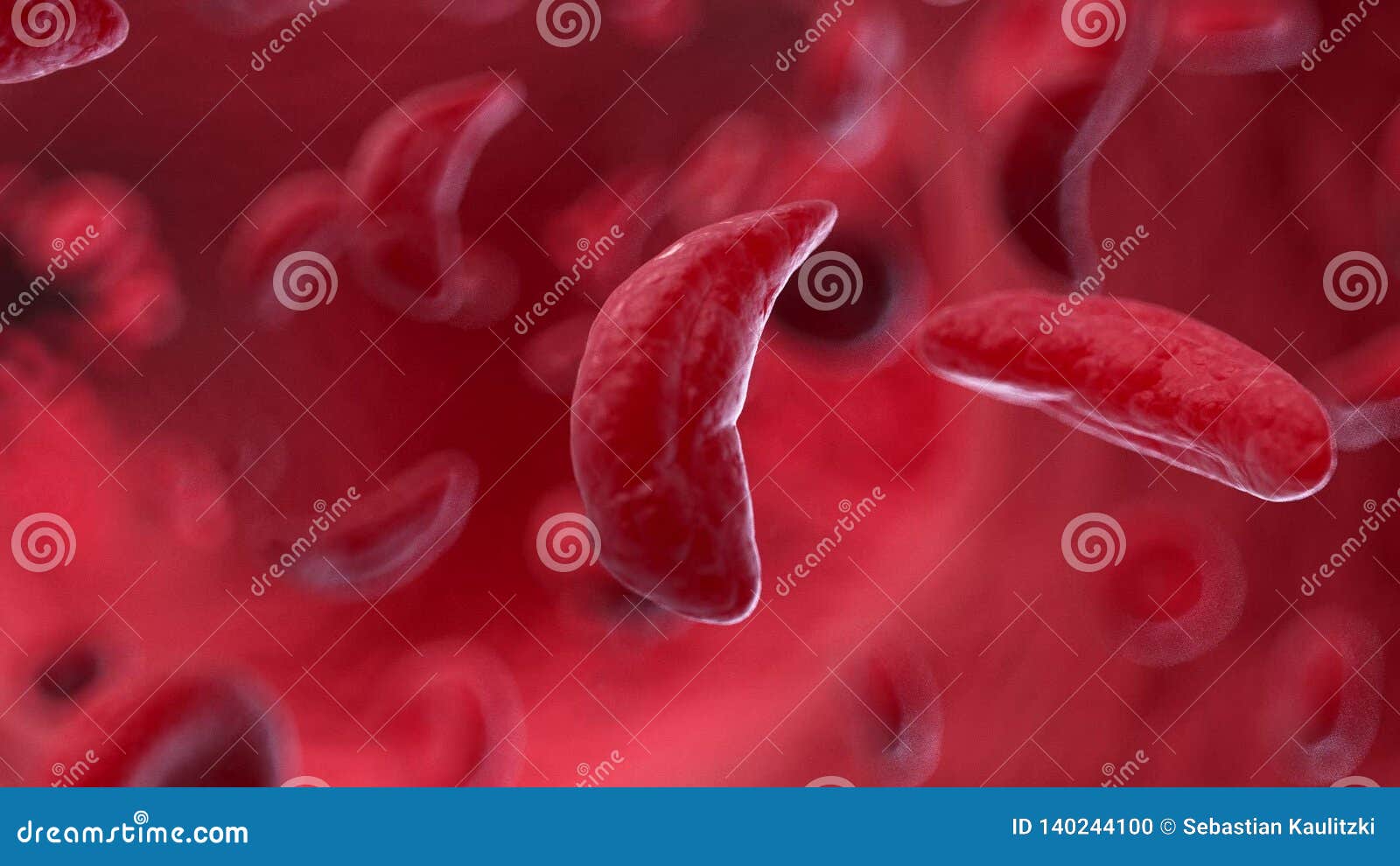 Sicklecell Cartoons, Illustrations & Vector Stock Images - 78 Pictures ...
