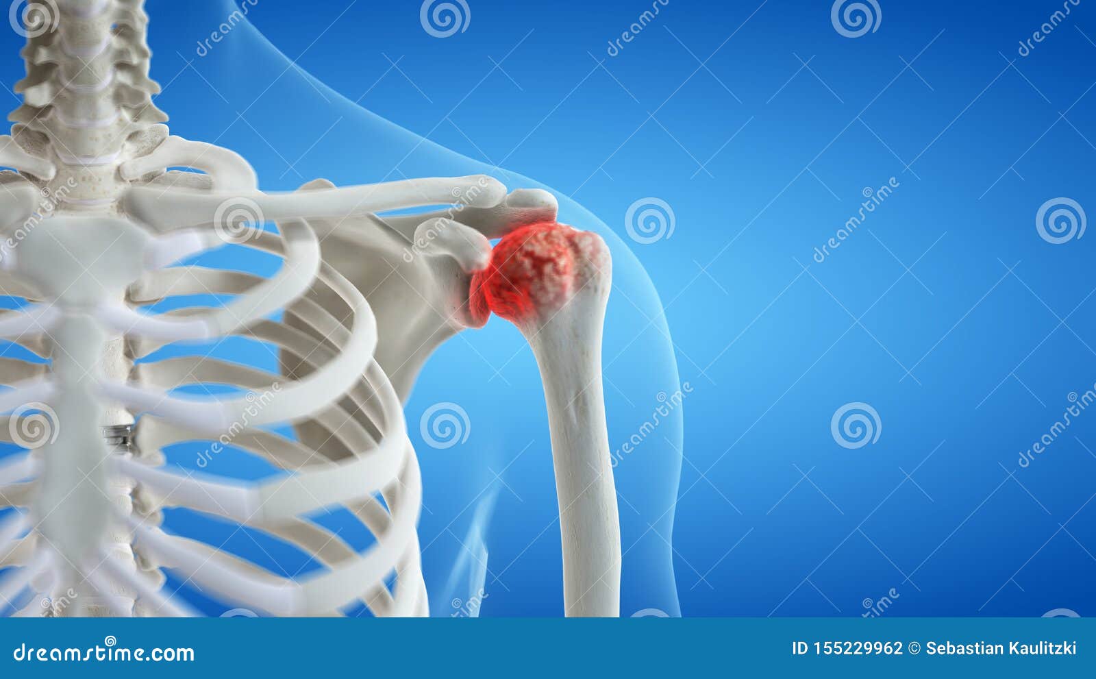 Shouder Cartoons, Illustrations & Vector Stock Images - 17 Pictures to ...