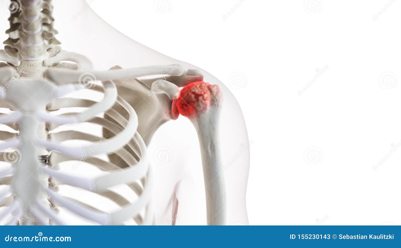 Shouder Cartoons, Illustrations & Vector Stock Images - 17 Pictures to ...