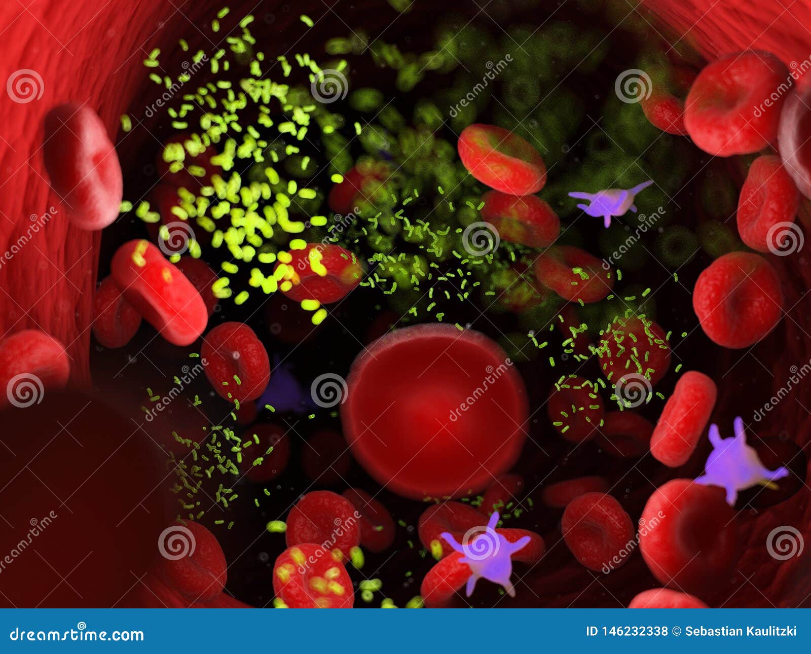 Bacterias in an artery stock illustration. Illustration of disease ...