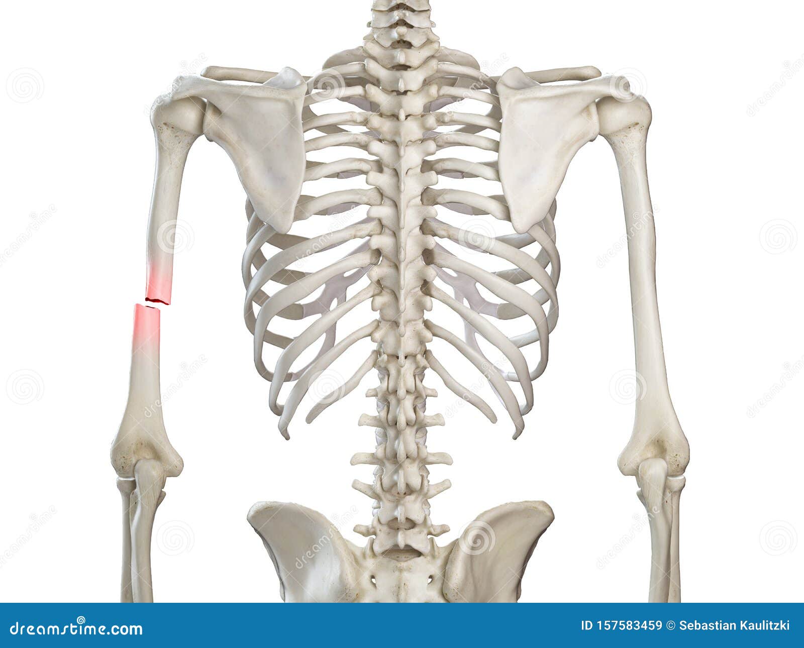 Humerus Cartoons, Illustrations & Vector Stock Images - 4210 Pictures ...