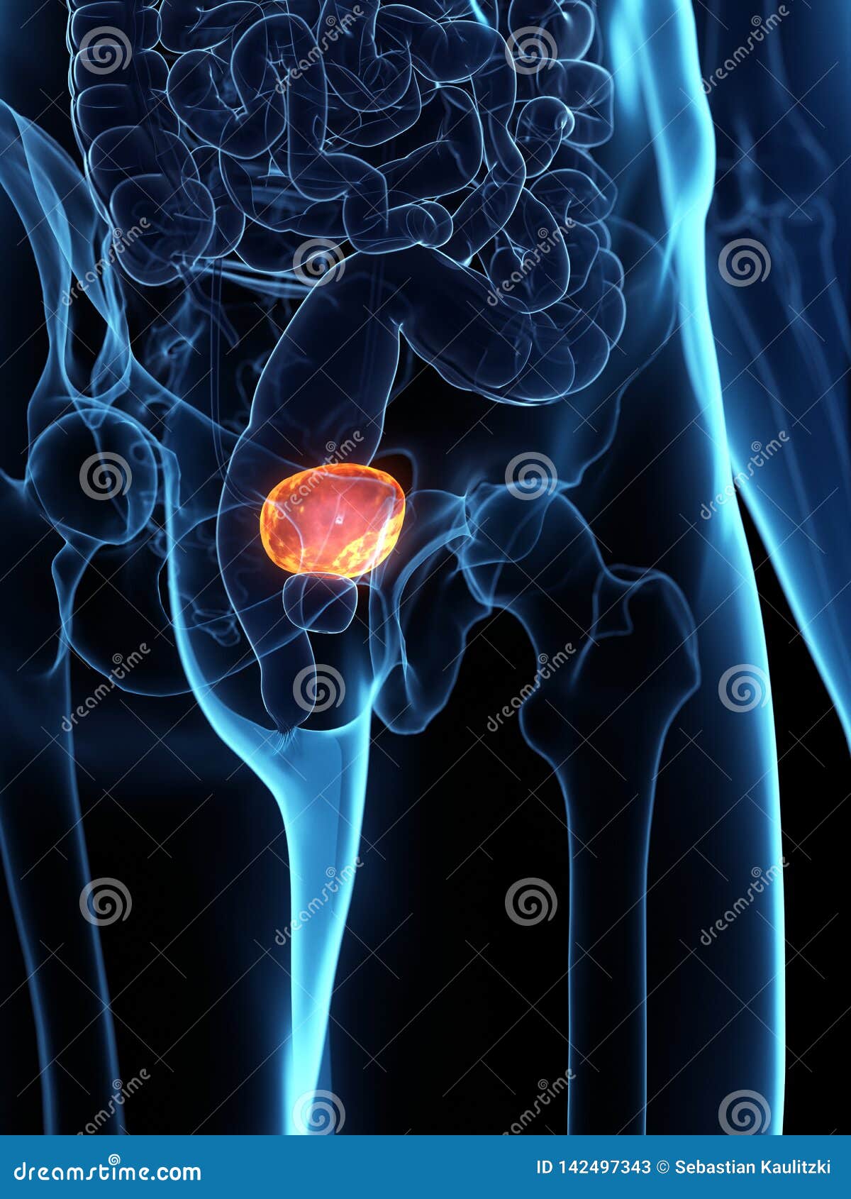 A diseased bladder stock illustration. Illustration of internal - 142497343