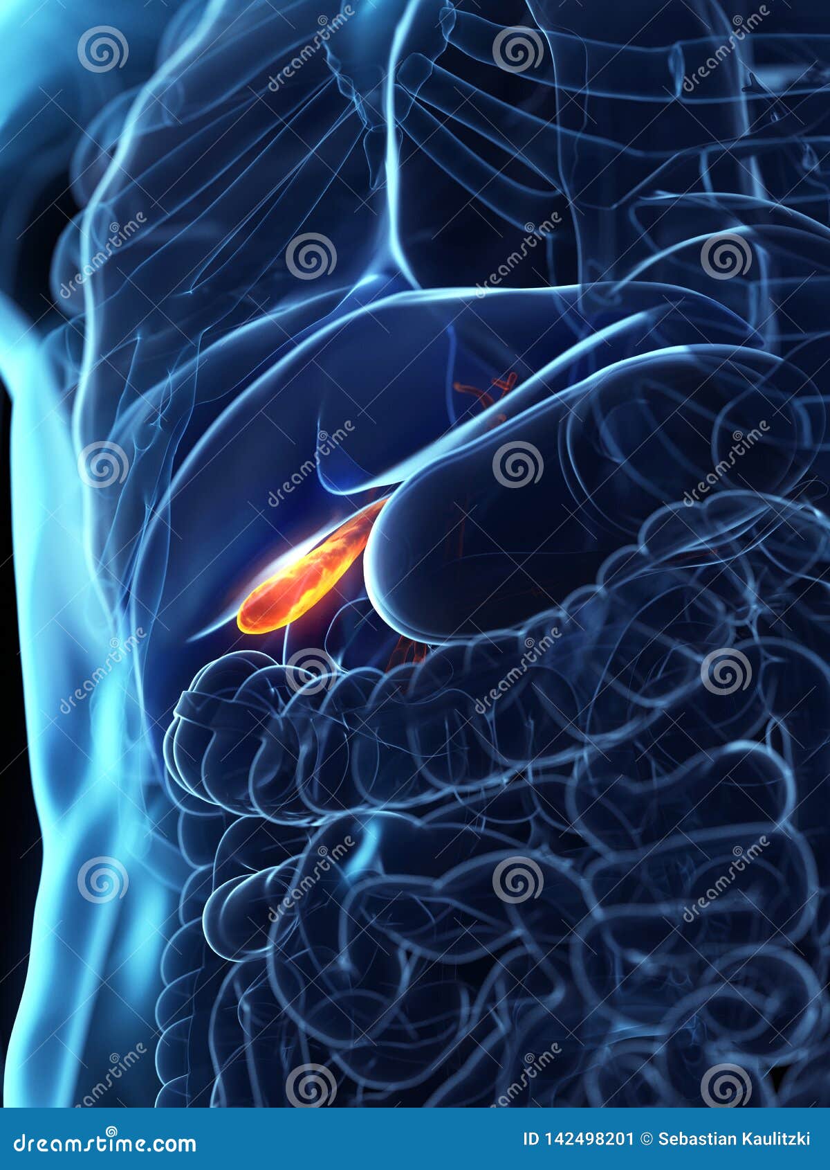A diseased gallbladder stock illustration. Illustration of pain - 142498201