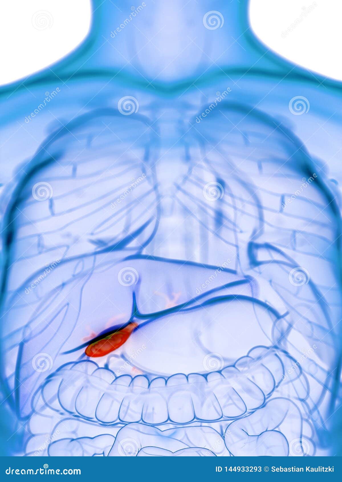 Symptoms Of Gallbladder Inflammation. Cholecystitis. Vector ...