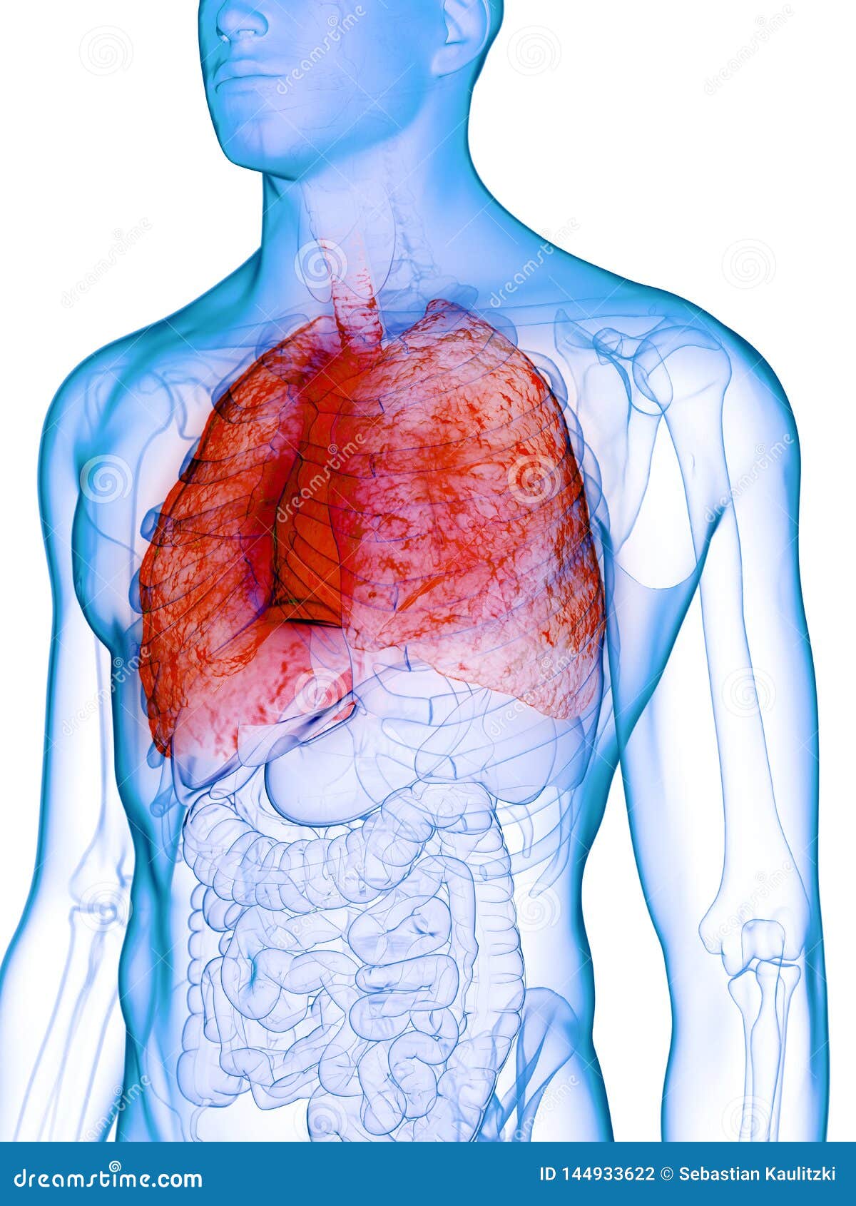Pneumoconiosis And Painful Human Condition, Pictured As A Wooden Human ...