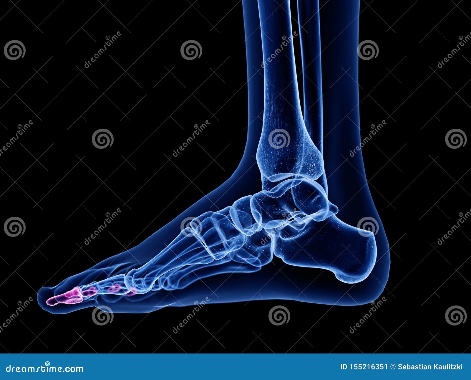 Distal Phalanx Bones In Red Color With Body 3D Rendering Illustration ...