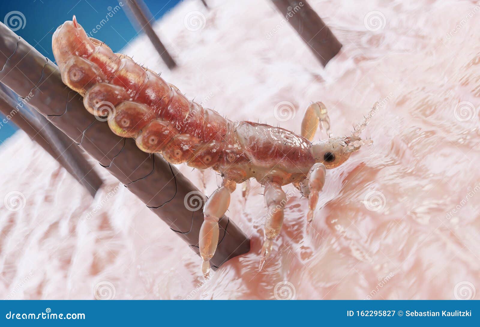 Body Louse Illustration, Drawing, Engraving, Ink, Line Art, Vector ...