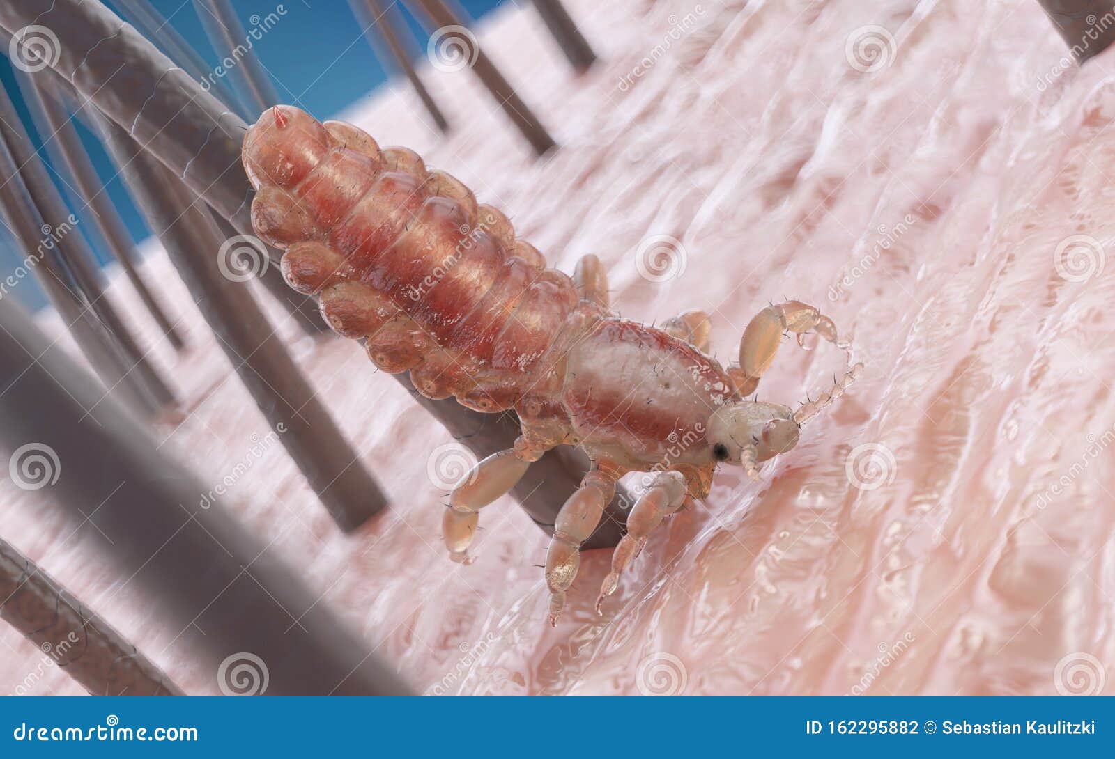 Body Louse Illustration, Drawing, Engraving, Ink, Line Art, Vector ...