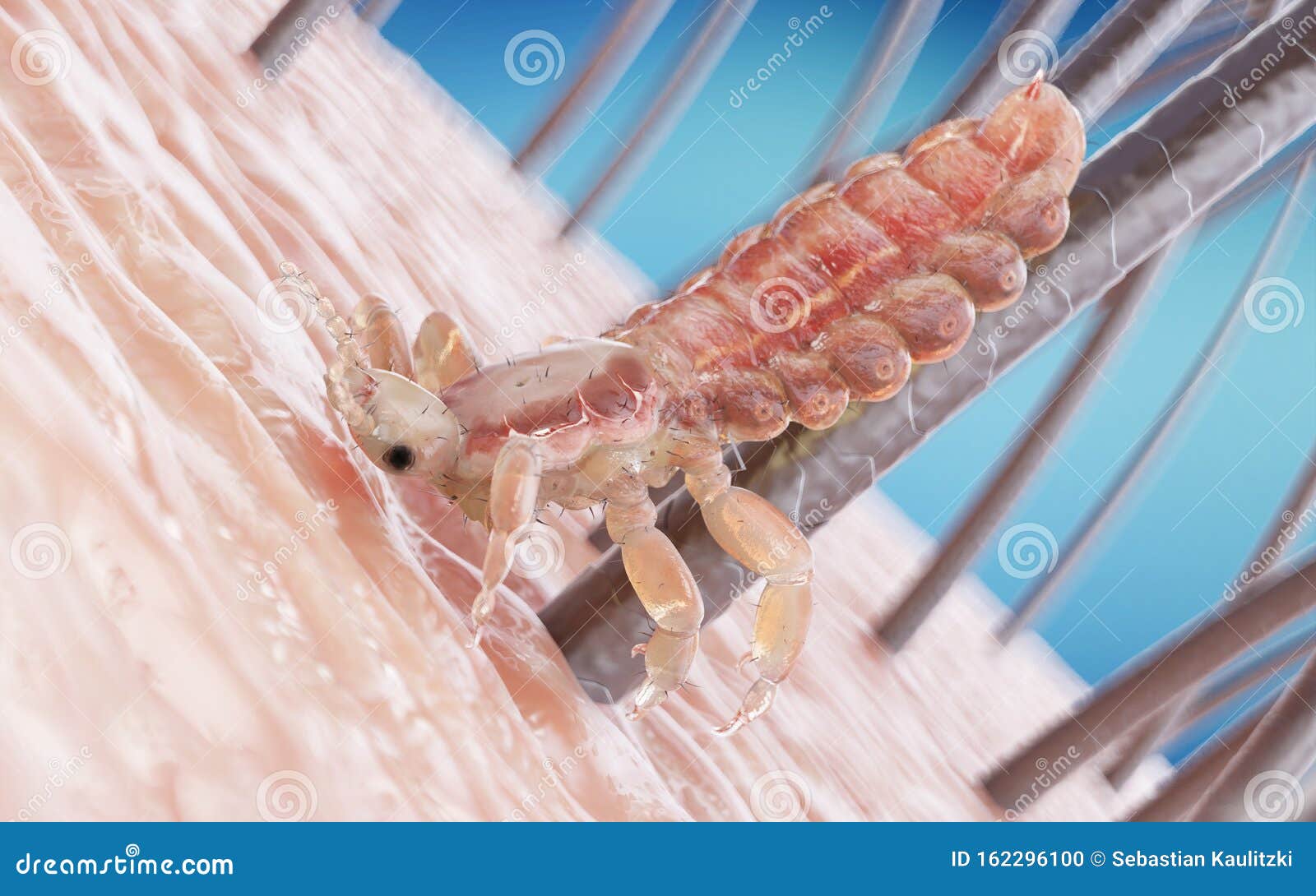 A head louse stock illustration. Illustration of bite - 162296100