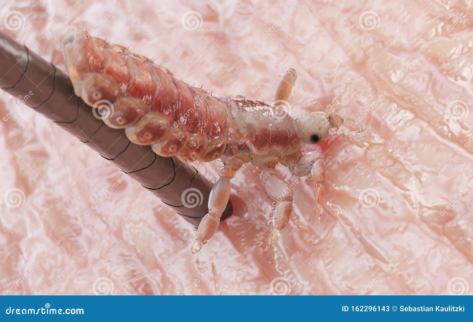 Body Louse Illustration, Drawing, Engraving, Ink, Line Art, Vector ...