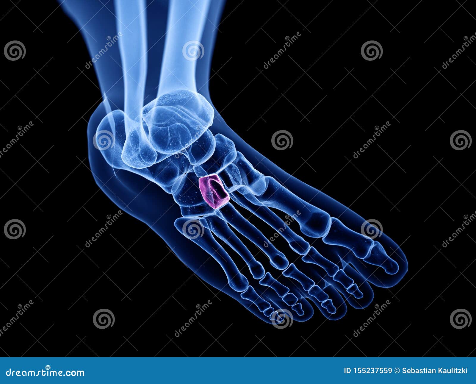The lateral cuneiform bone stock illustration. Illustration of ...