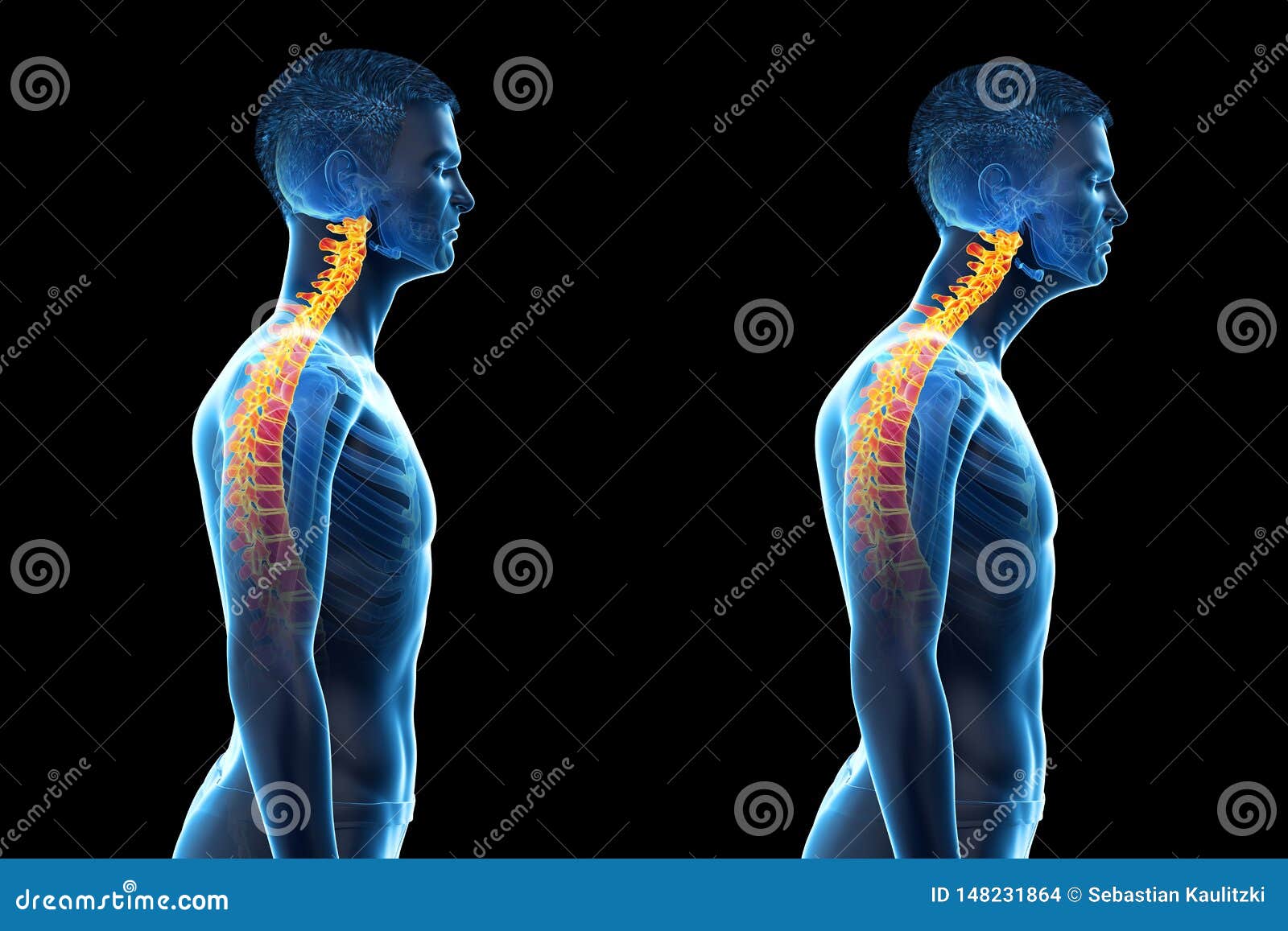 A Man with a Forward Head Posture Stock Illustration - Illustration of ...