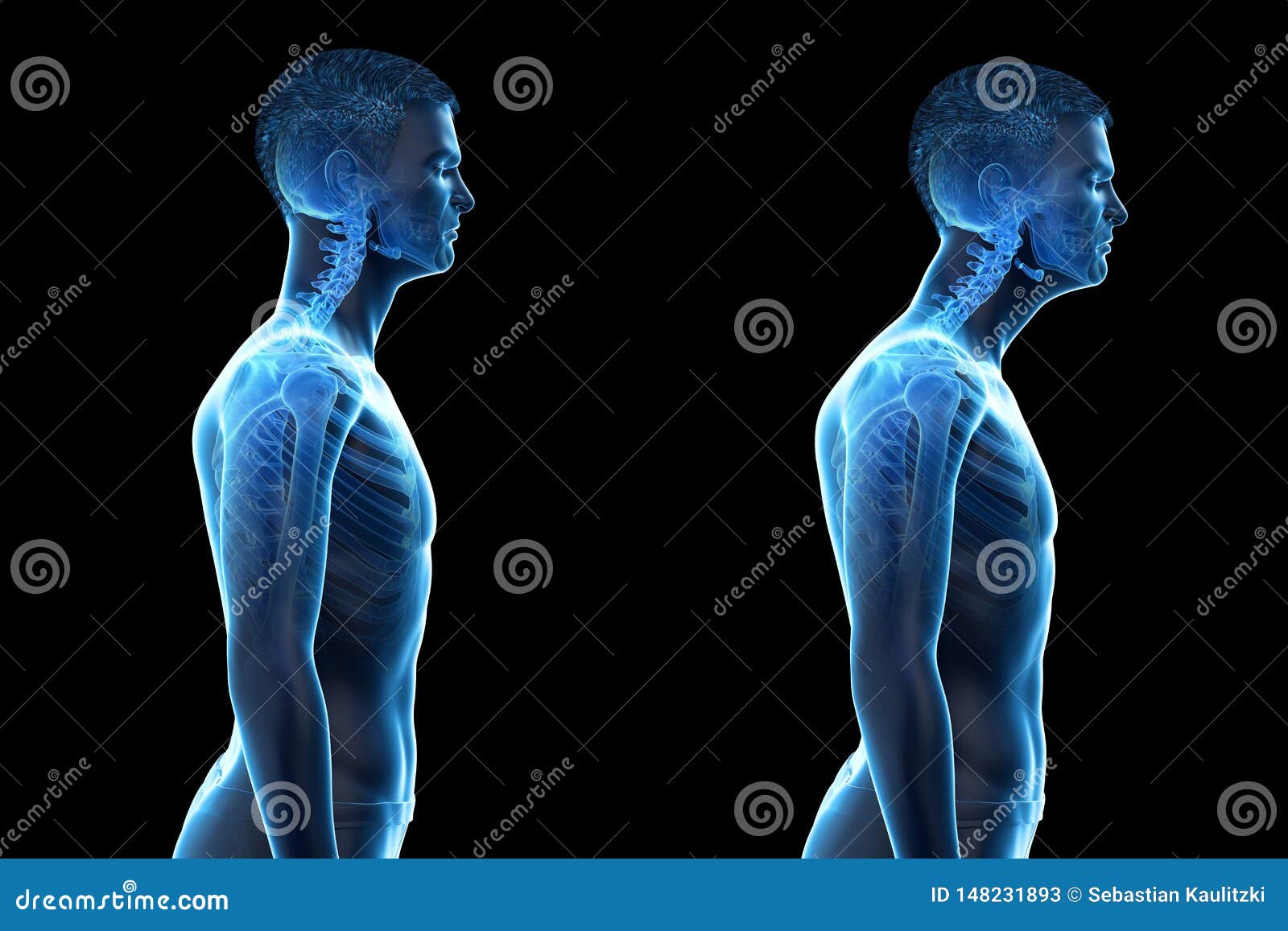 A Man with a Forward Head Posture Stock Illustration - Illustration of ...