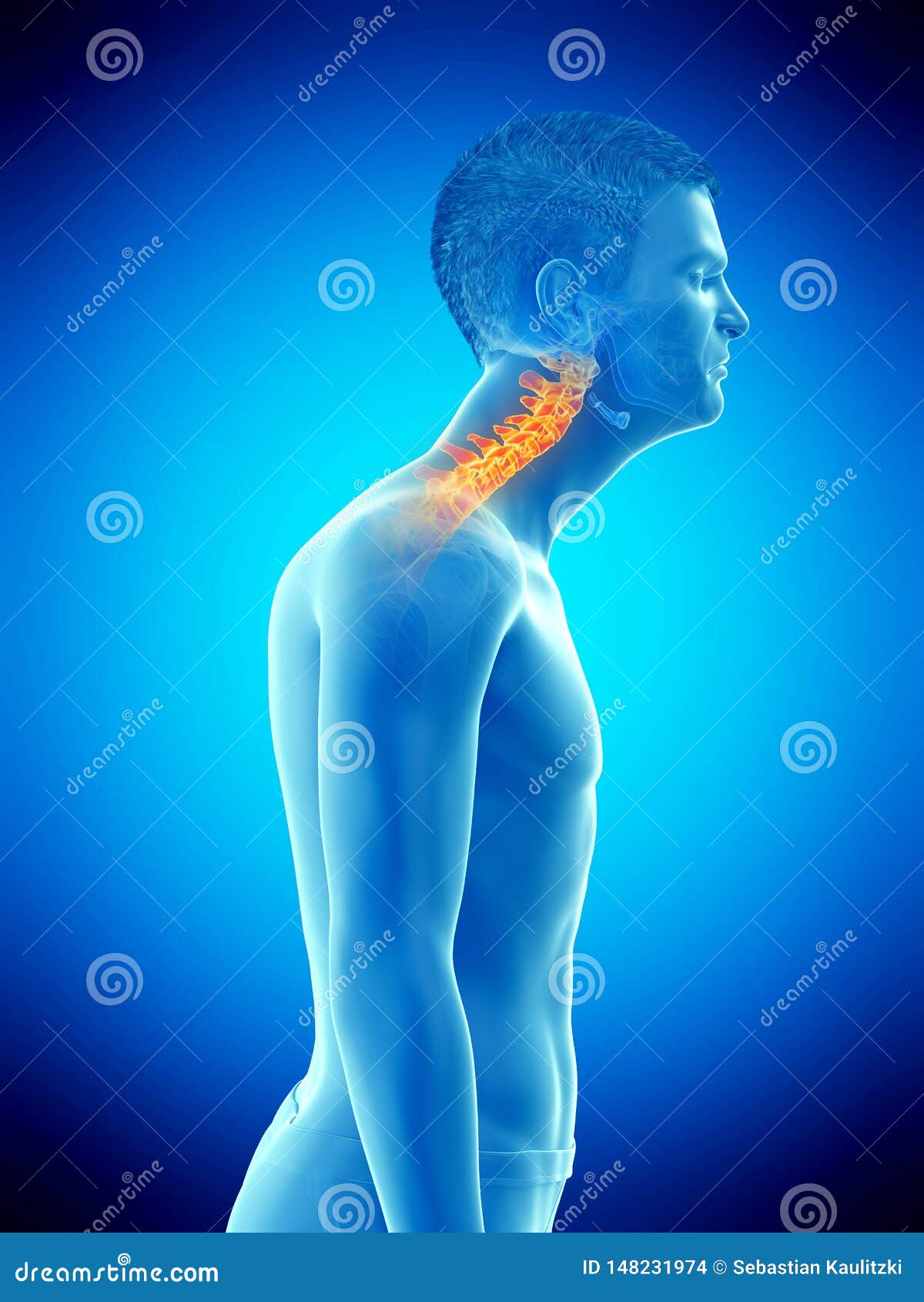 A Man with a Forward Head Posture Stock Illustration - Illustration of ...