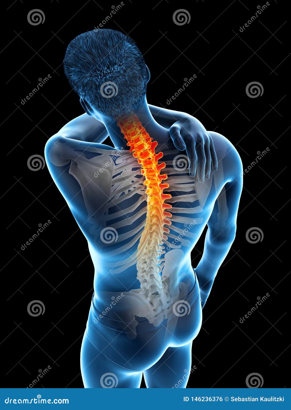 A man having a backache stock illustration. Illustration of inflamed ...