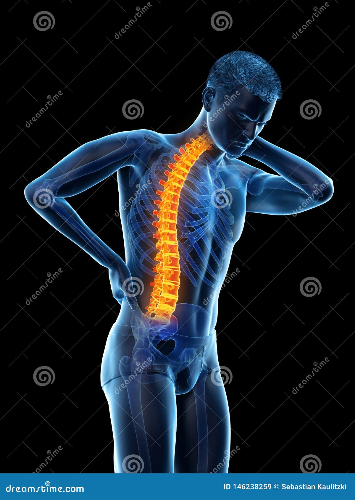 A man having a backache stock illustration. Illustration of pain ...