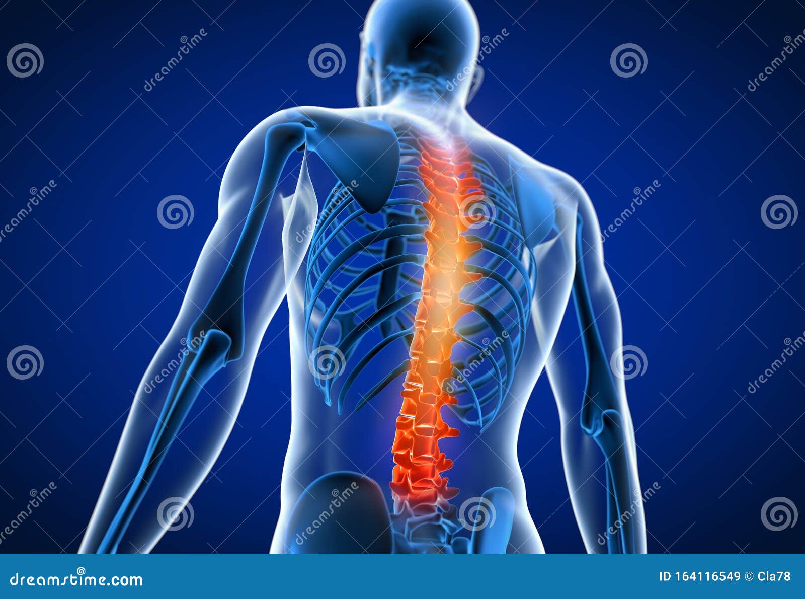 3d Rendered Medically Accurate Illustration of a Man Having a Painful ...