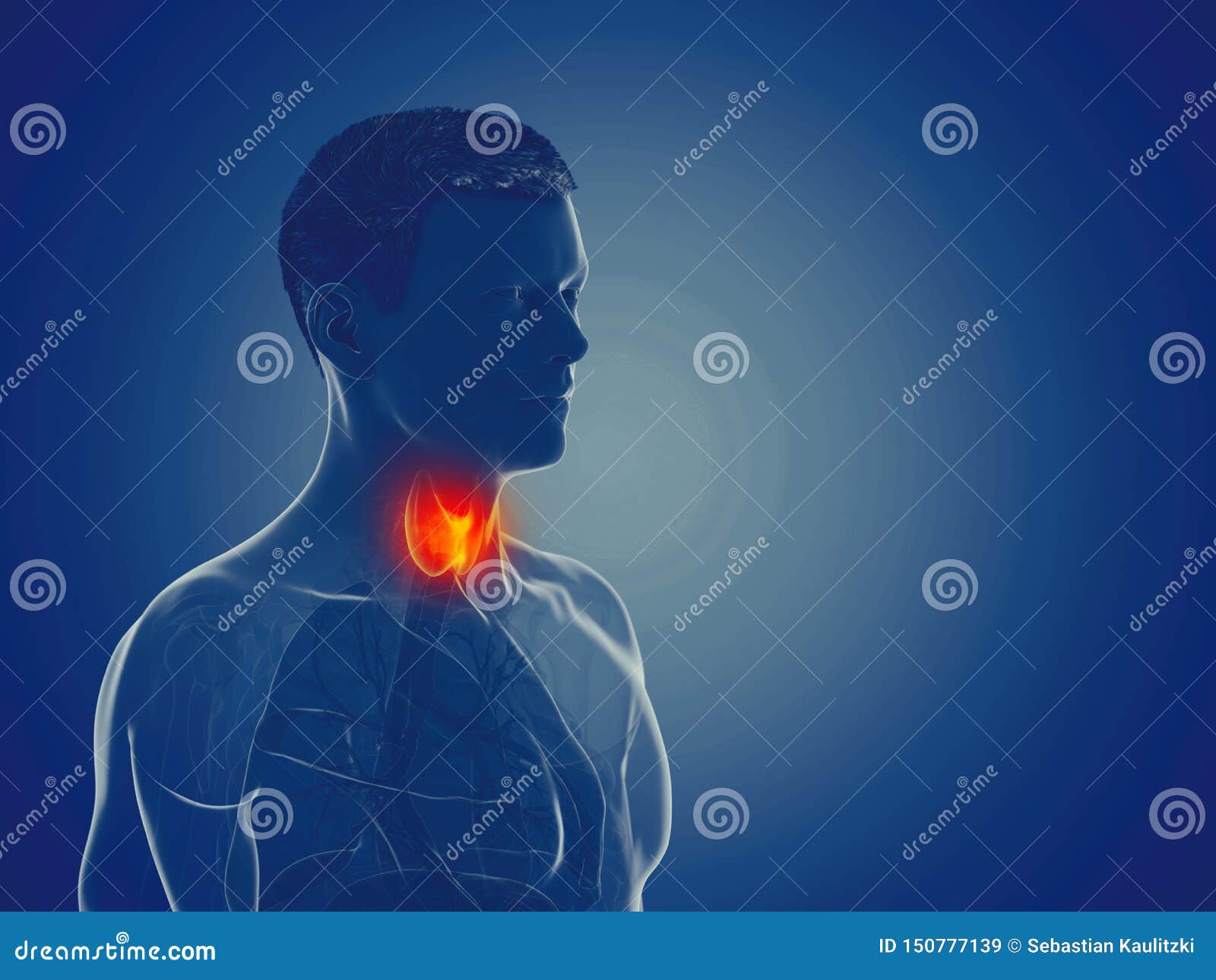 A mans thyroid gland stock illustration. Illustration of inflamed ...