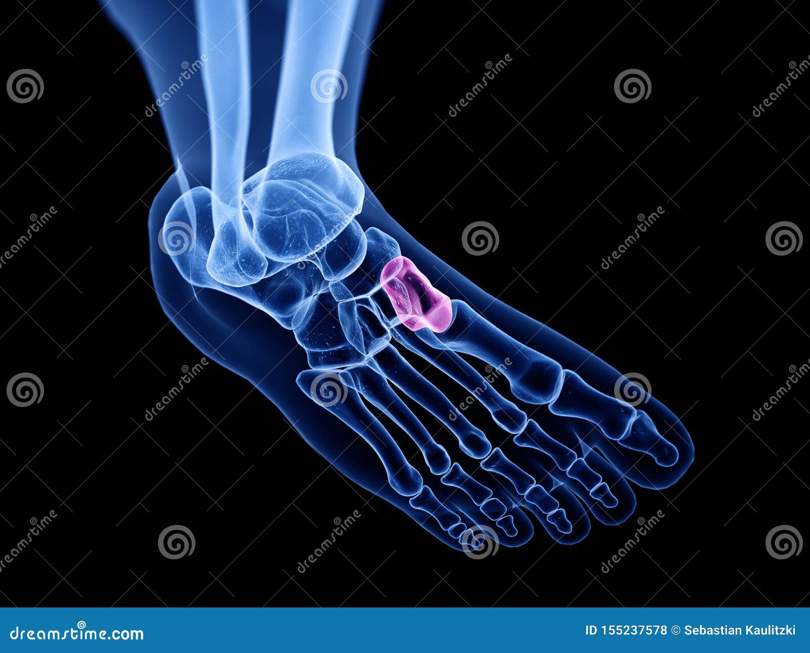 The medial cuneiform bone stock illustration. Illustration of health ...