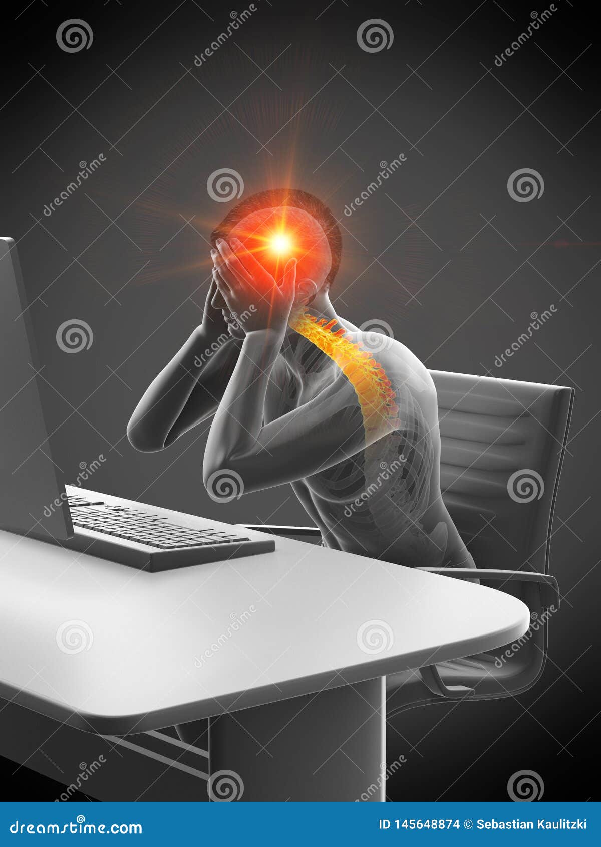 An Office Worker Having a Headache Stock Illustration - Illustration of ...