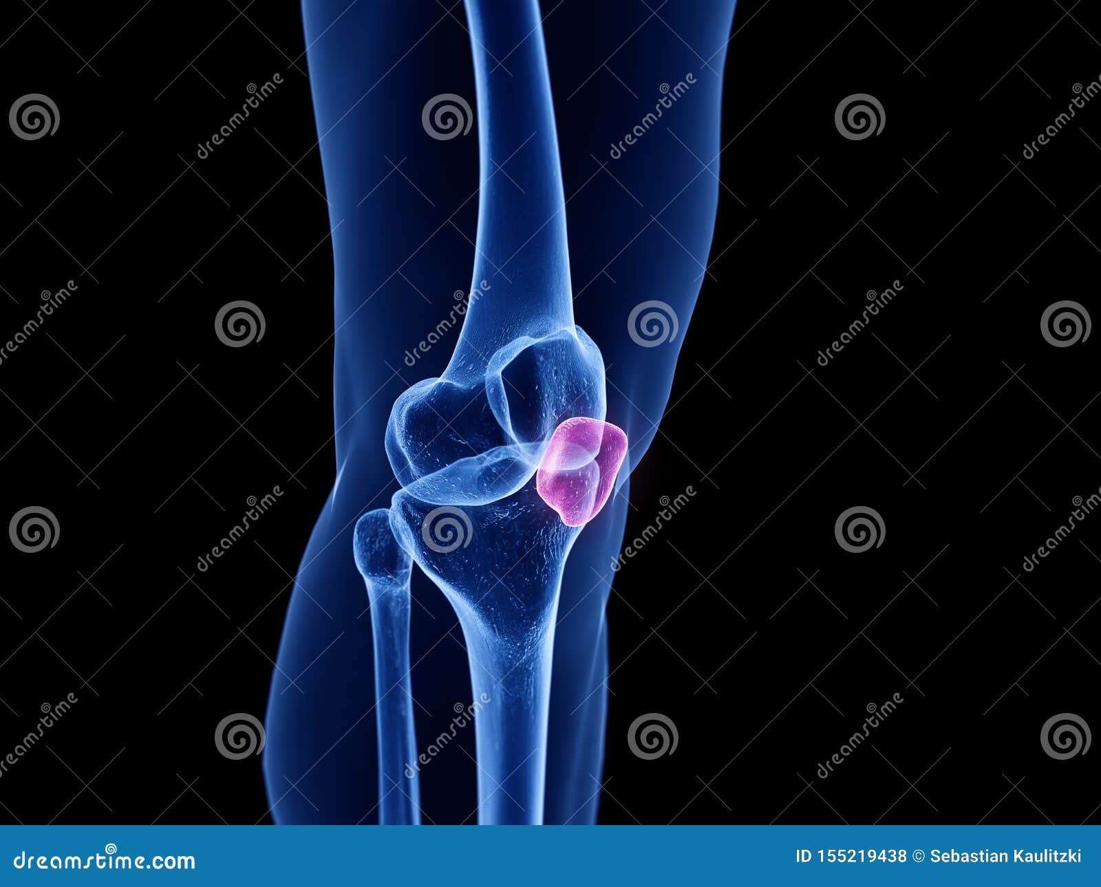 Patella Bone Stock Illustration | CartoonDealer.com #88900738