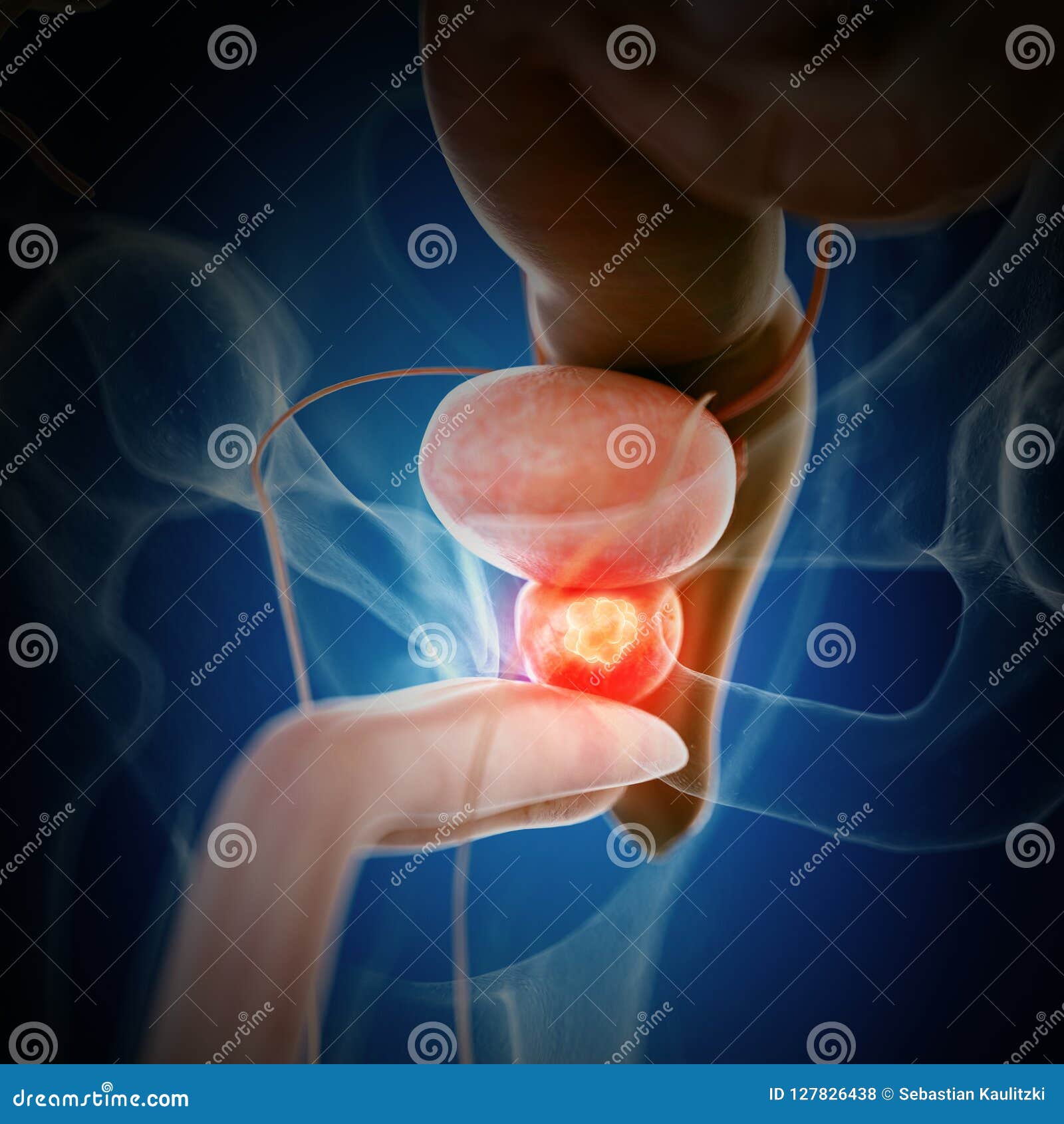 Prostate Cancer Symptoms Causes Diagnostics Flat Icons Set Vector