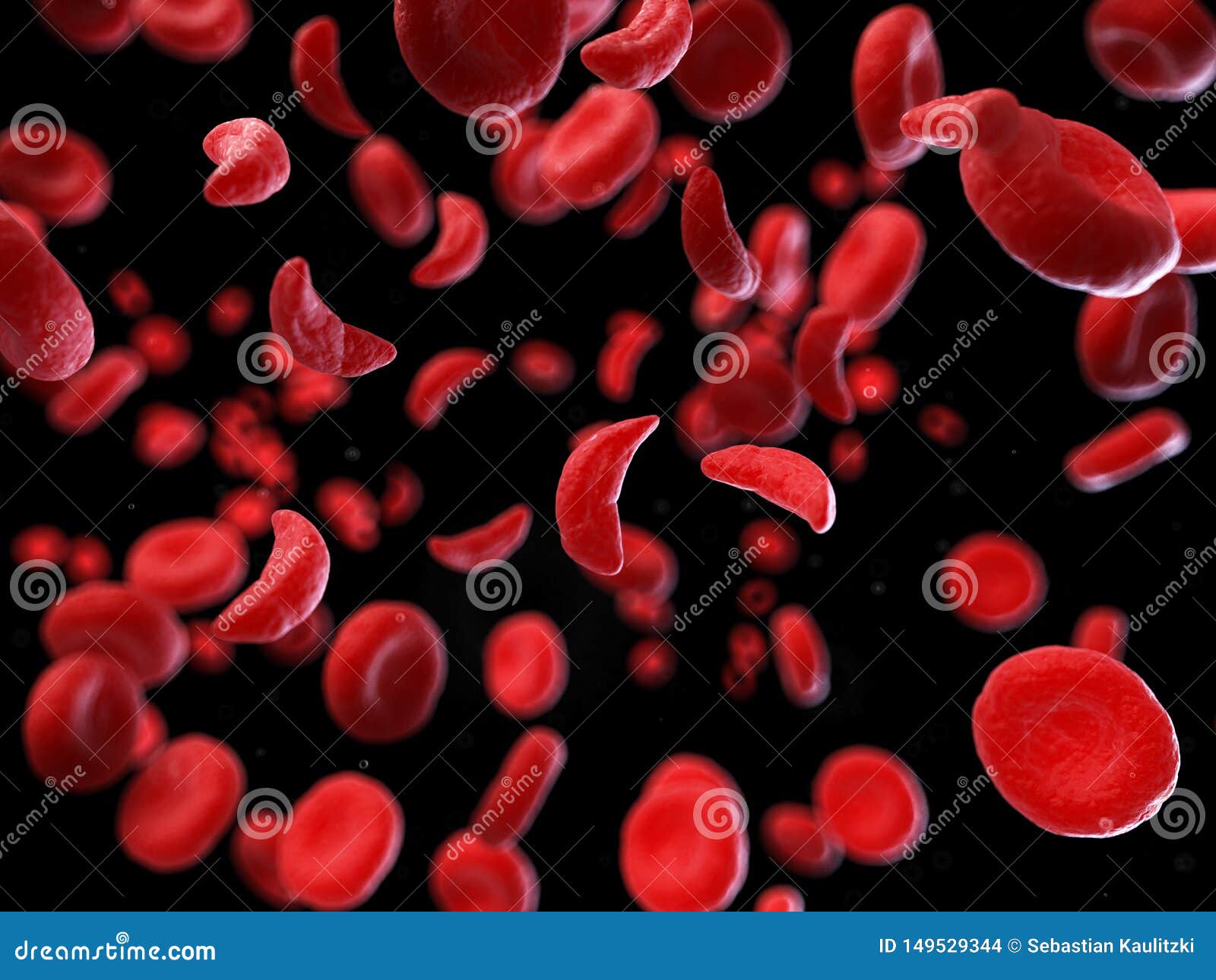Sickle cells stock illustration. Illustration of circulatory - 149529344