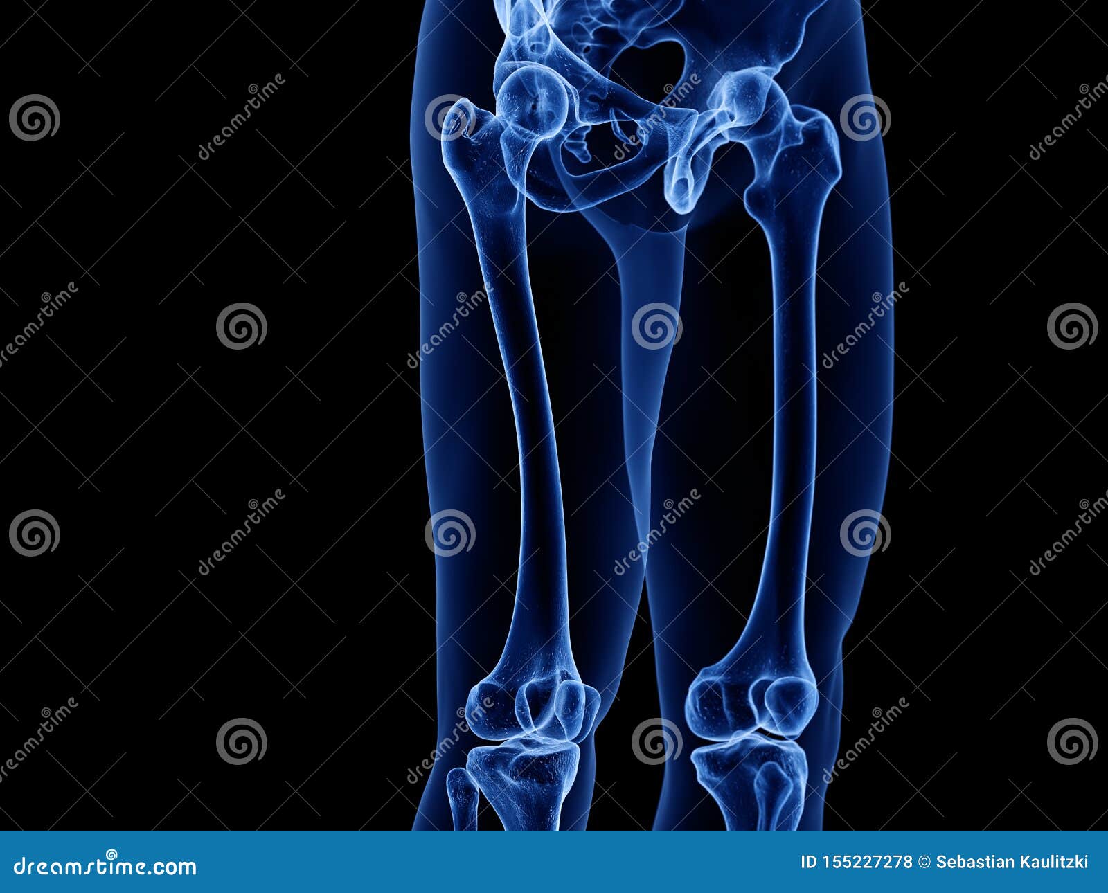 Bones Of The Upper Limb Lateral View Royalty-Free Stock Image ...