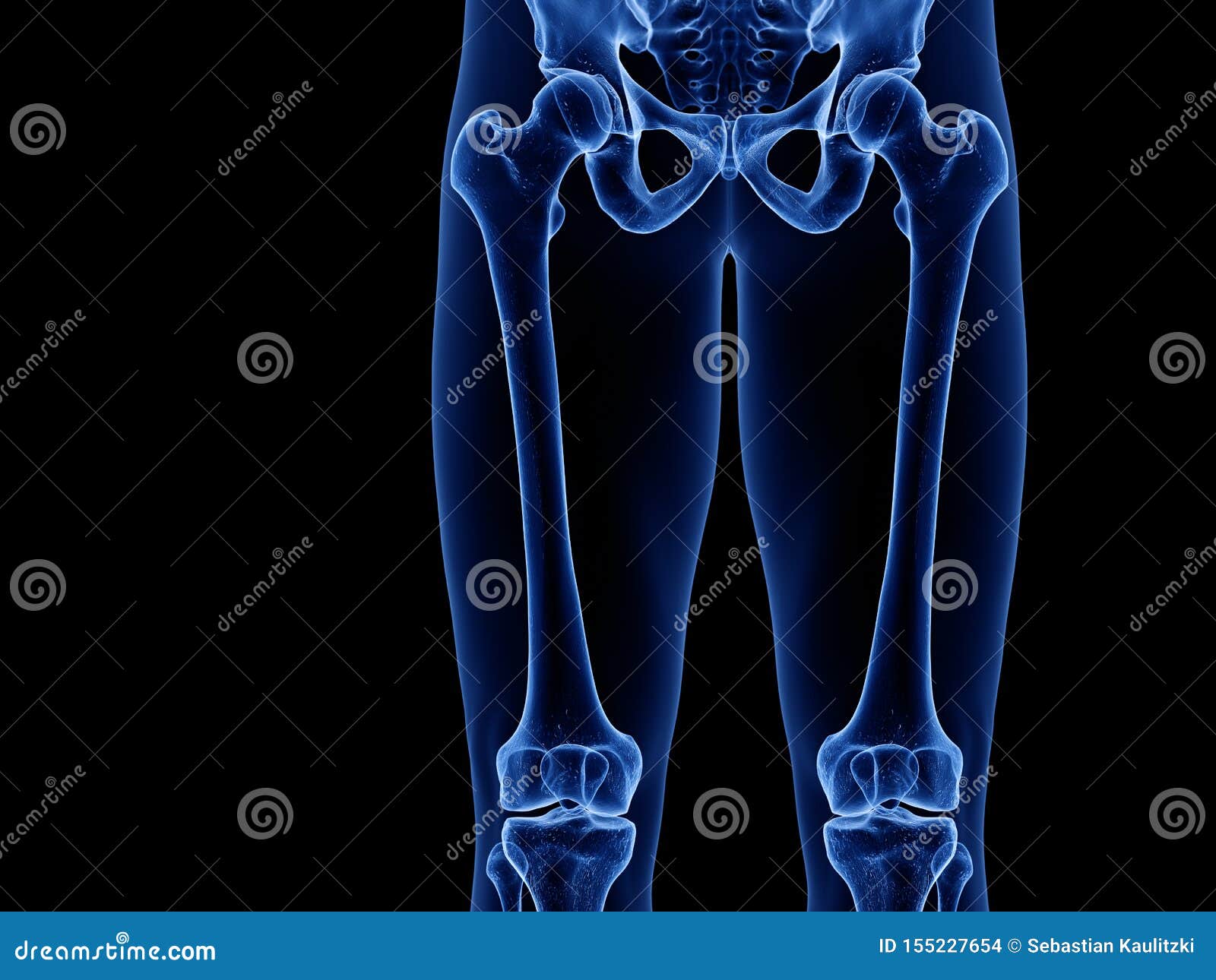 Bones Of The Upper Limb Lateral View Royalty-Free Stock Image ...