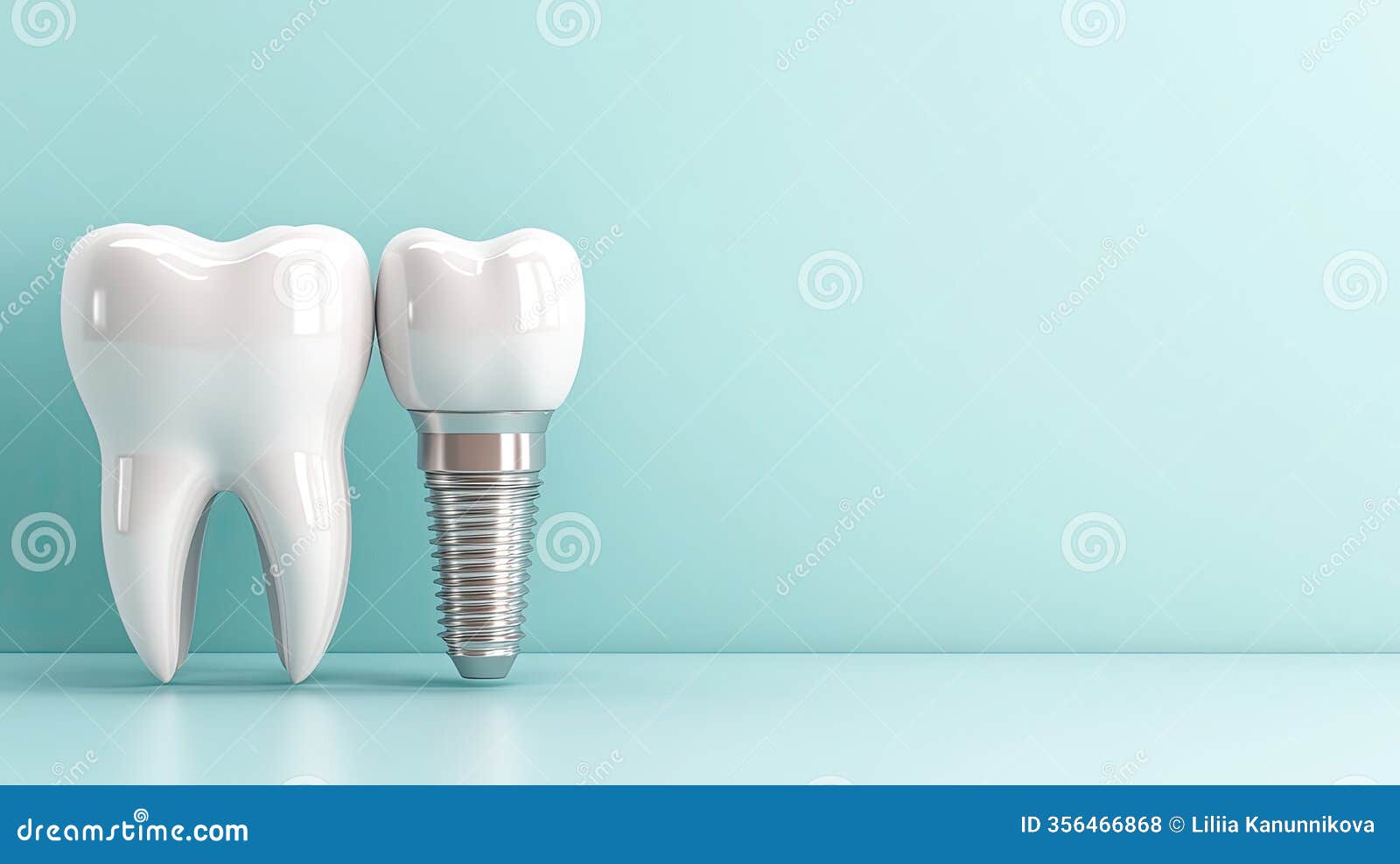 3D-rendered Visualization Shows a Tooth with a Metal Implant Post and ...