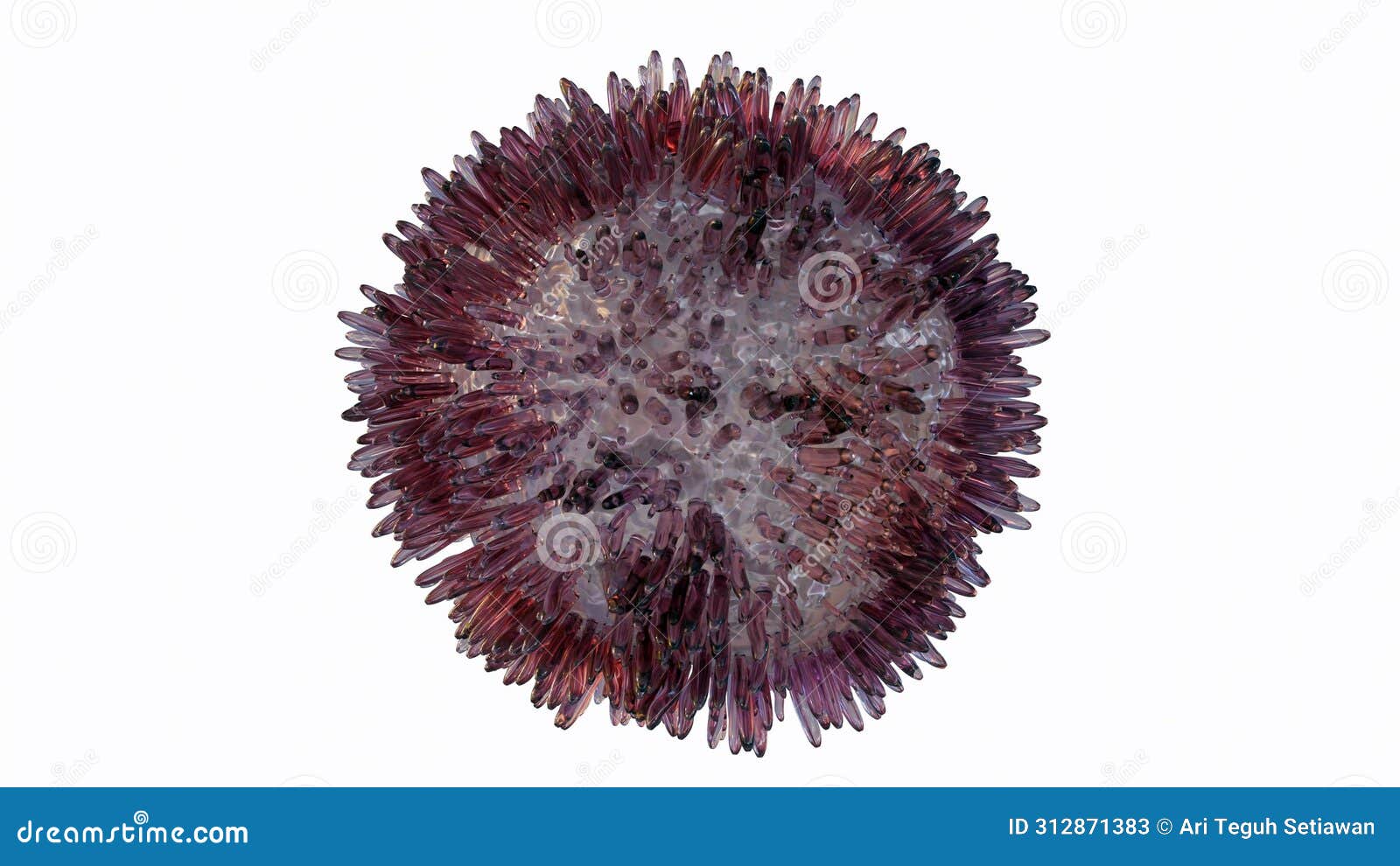 Hairy Cell Leukemia (HCL) Or Known As Leukemic Reticuloendotheliosis ...