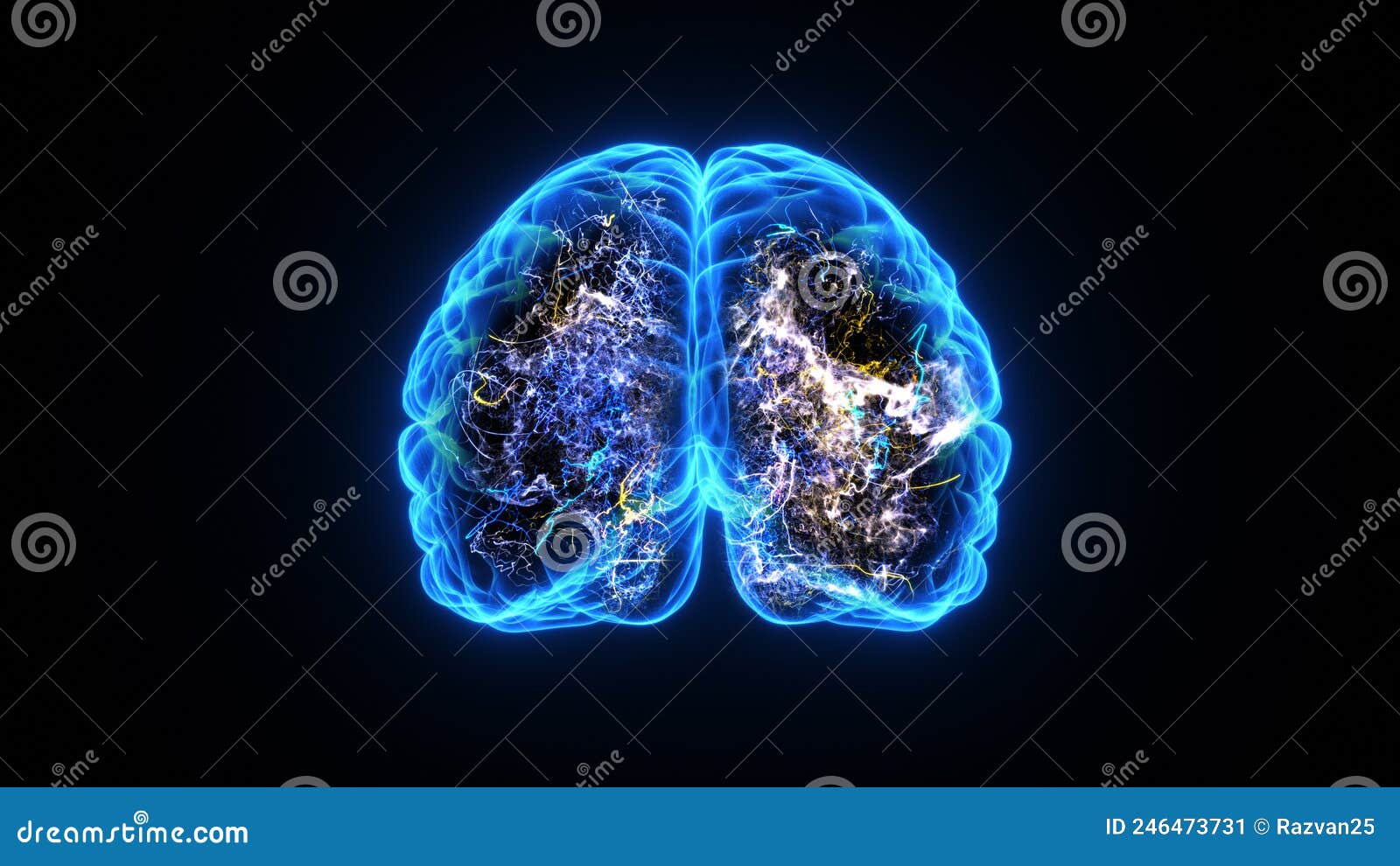3d Rendering of a Human Brain Electrical Activity Stock Illustration ...