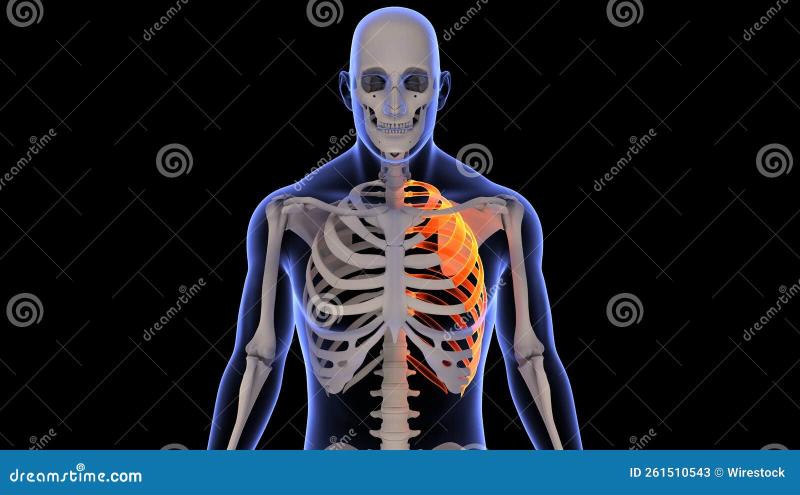3D Rendering of a Human X-ray with the Left Rib Bone Highlighted on a ...