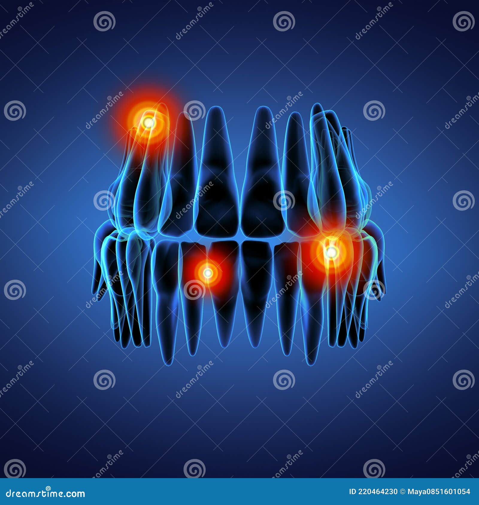 3d Rendering of Human Teeth Stock Illustration - Illustration of grind ...