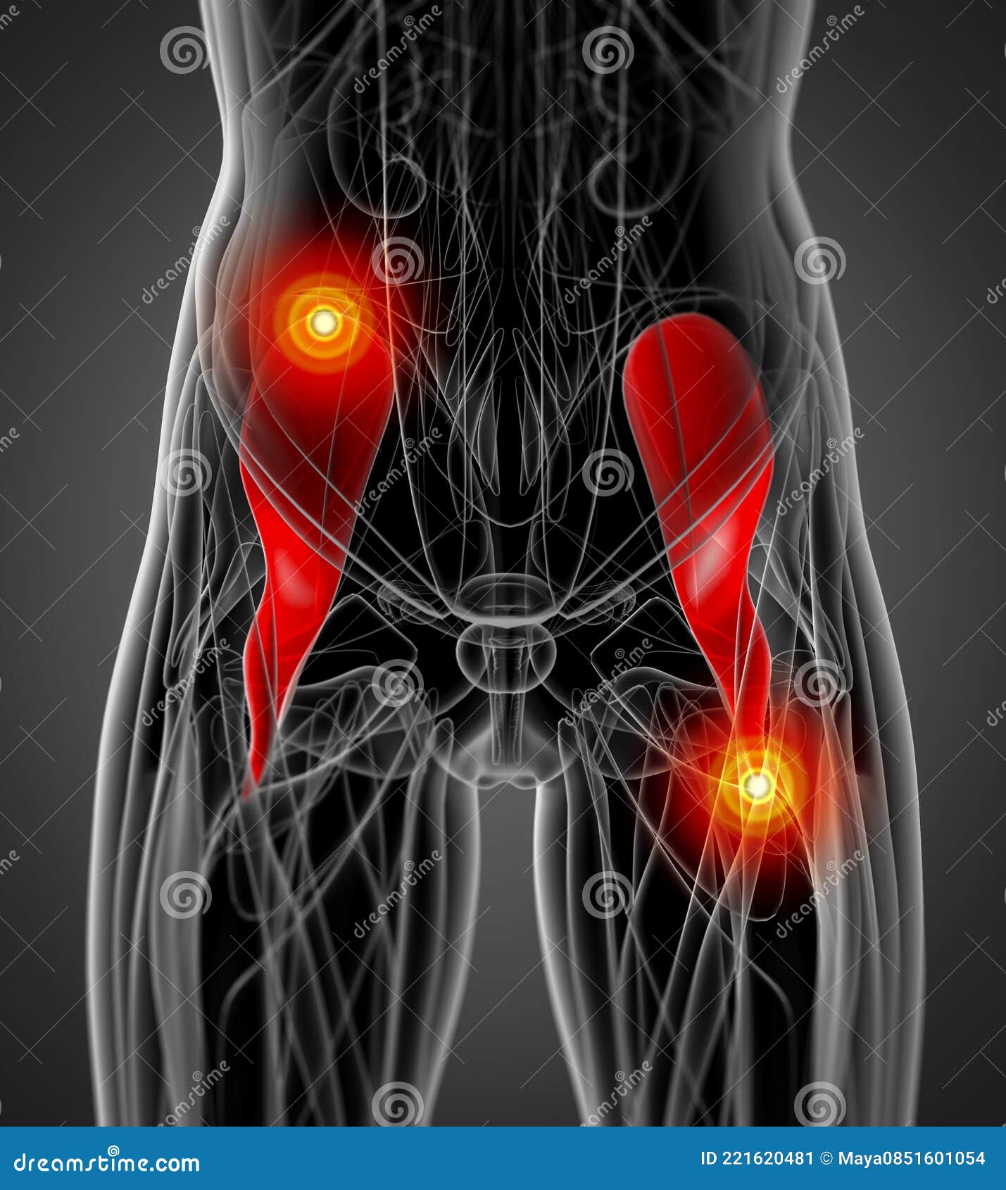 Medical Illustration of the Iliacus Stock Illustration - Illustration ...