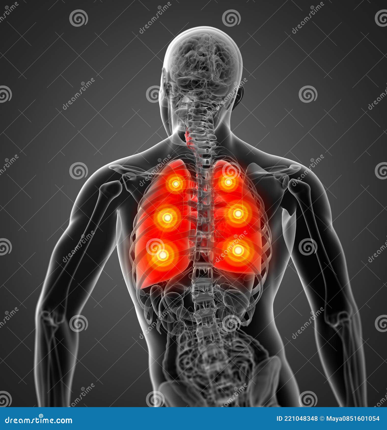 3D Rendering Illustration of Lung Stock Illustration - Illustration of ...