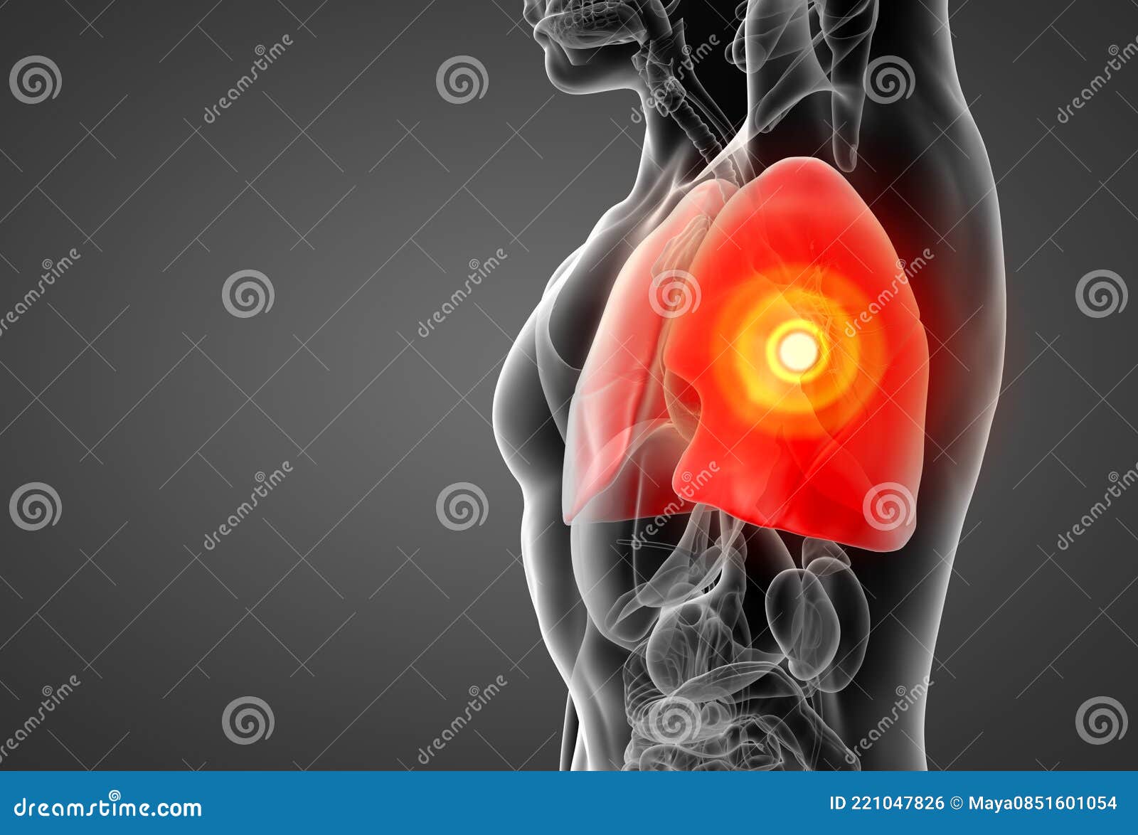 3D Rendering Illustration of Lung Stock Illustration - Illustration of ...